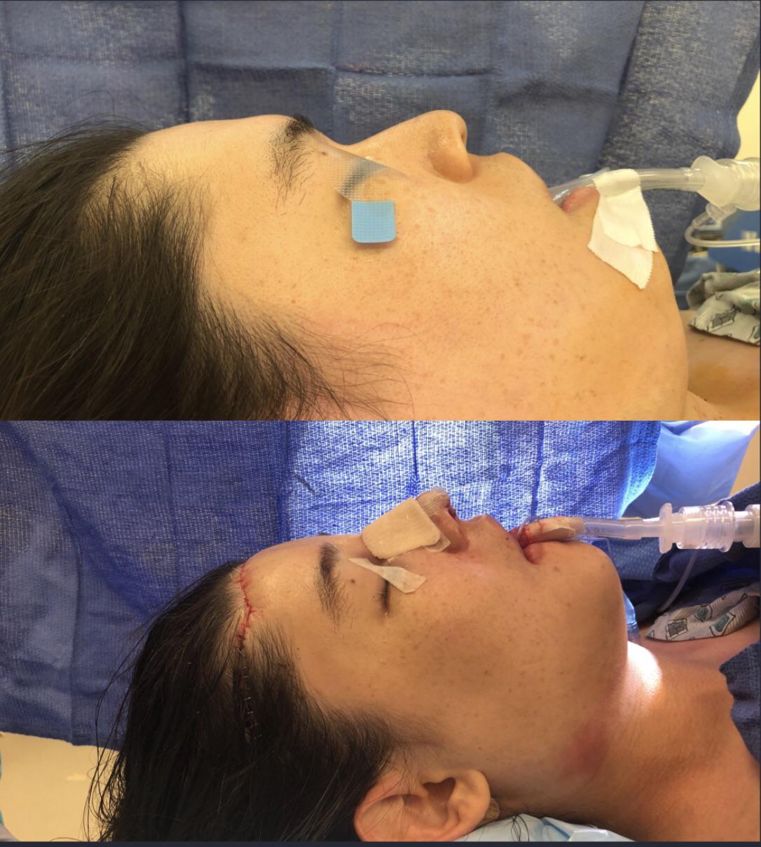 Dr. Kuperstock - Surgery Day | Scrolller