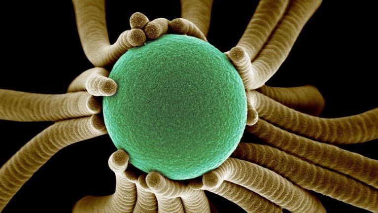 Electron Microscope: a series of Epoxy Resin Fibers assembling themselves around a 2 micrometer ...