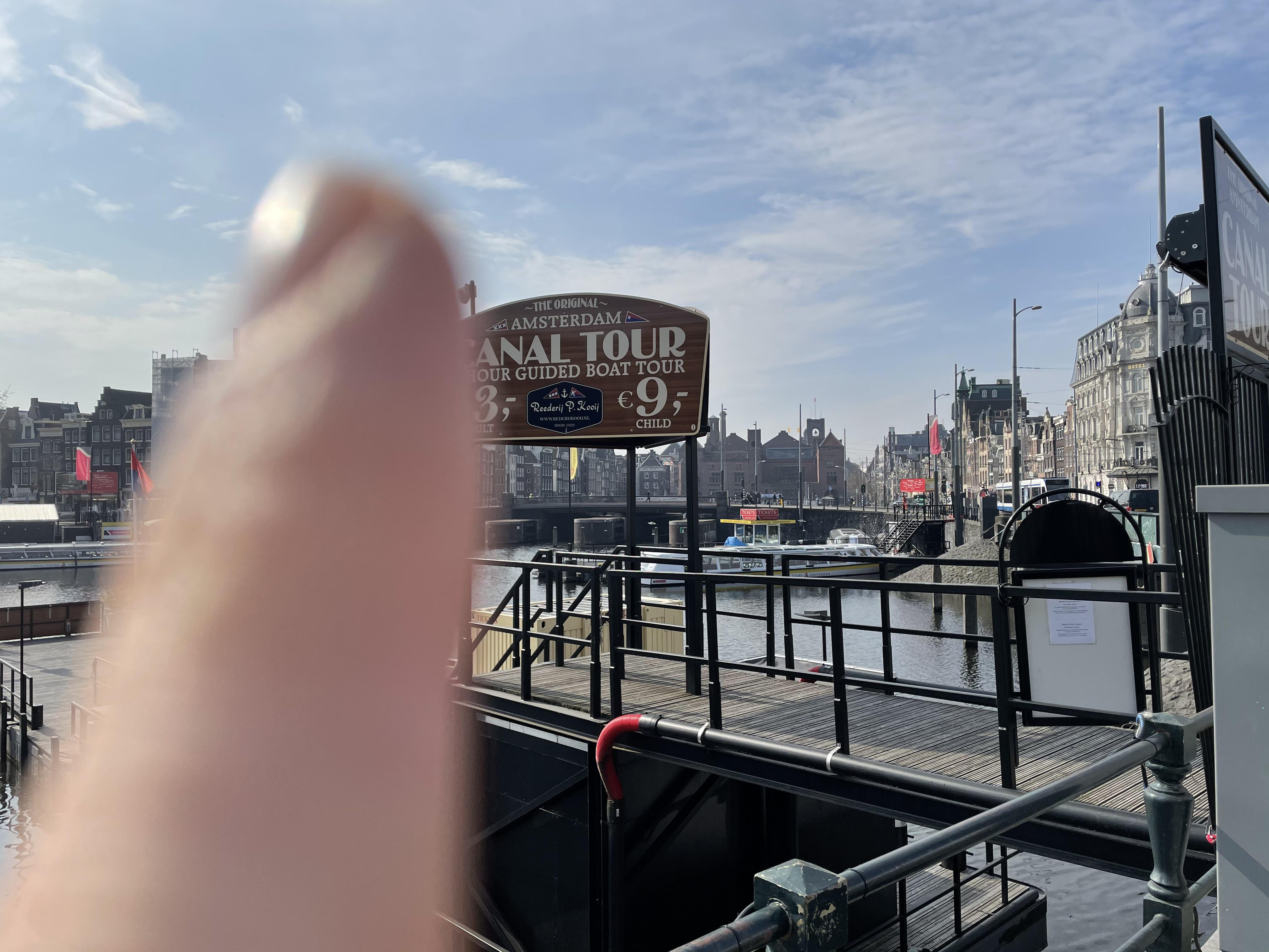 Everything wrong with this finger | Scrolller