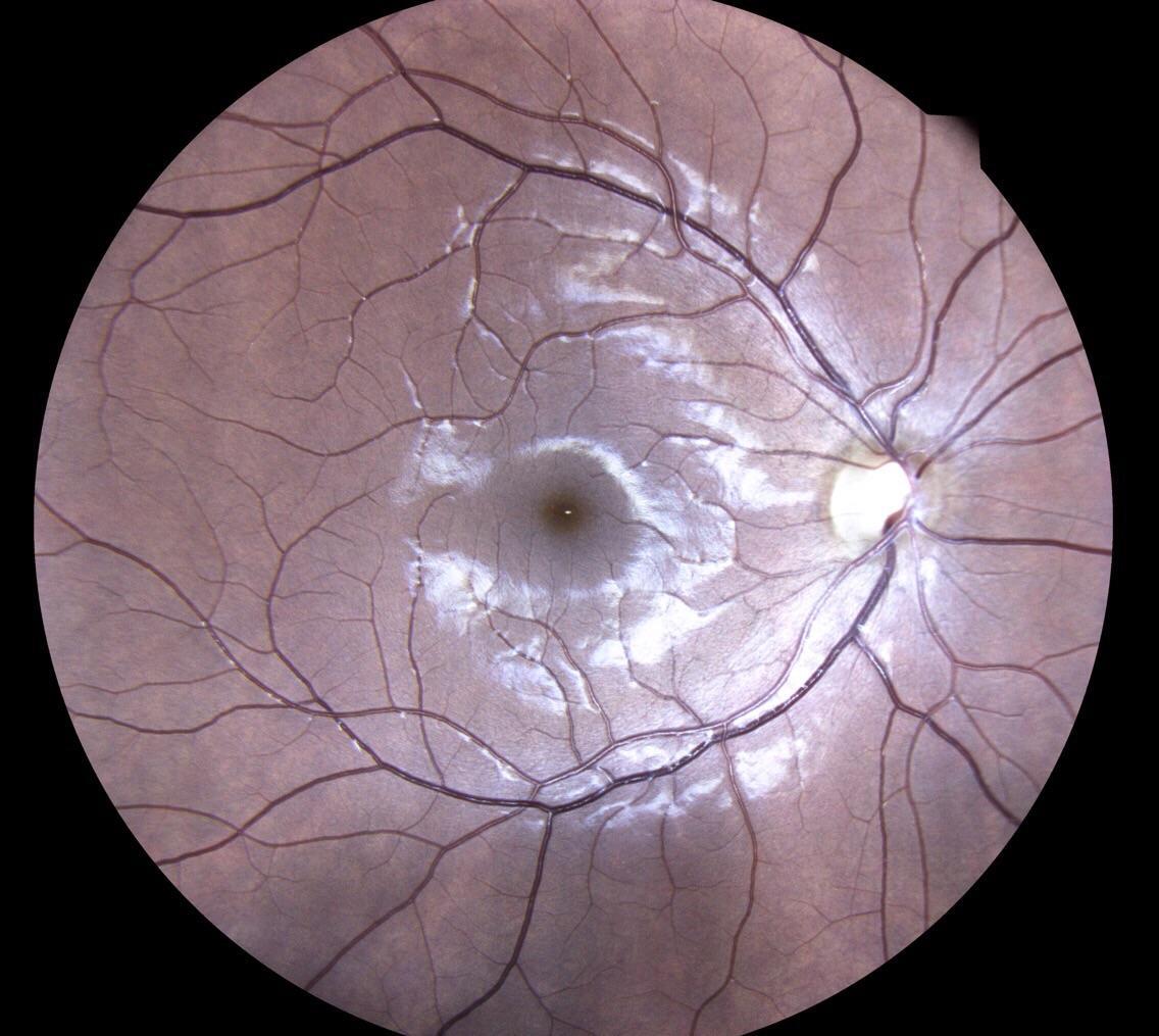 Eye Exam Photo | Scrolller