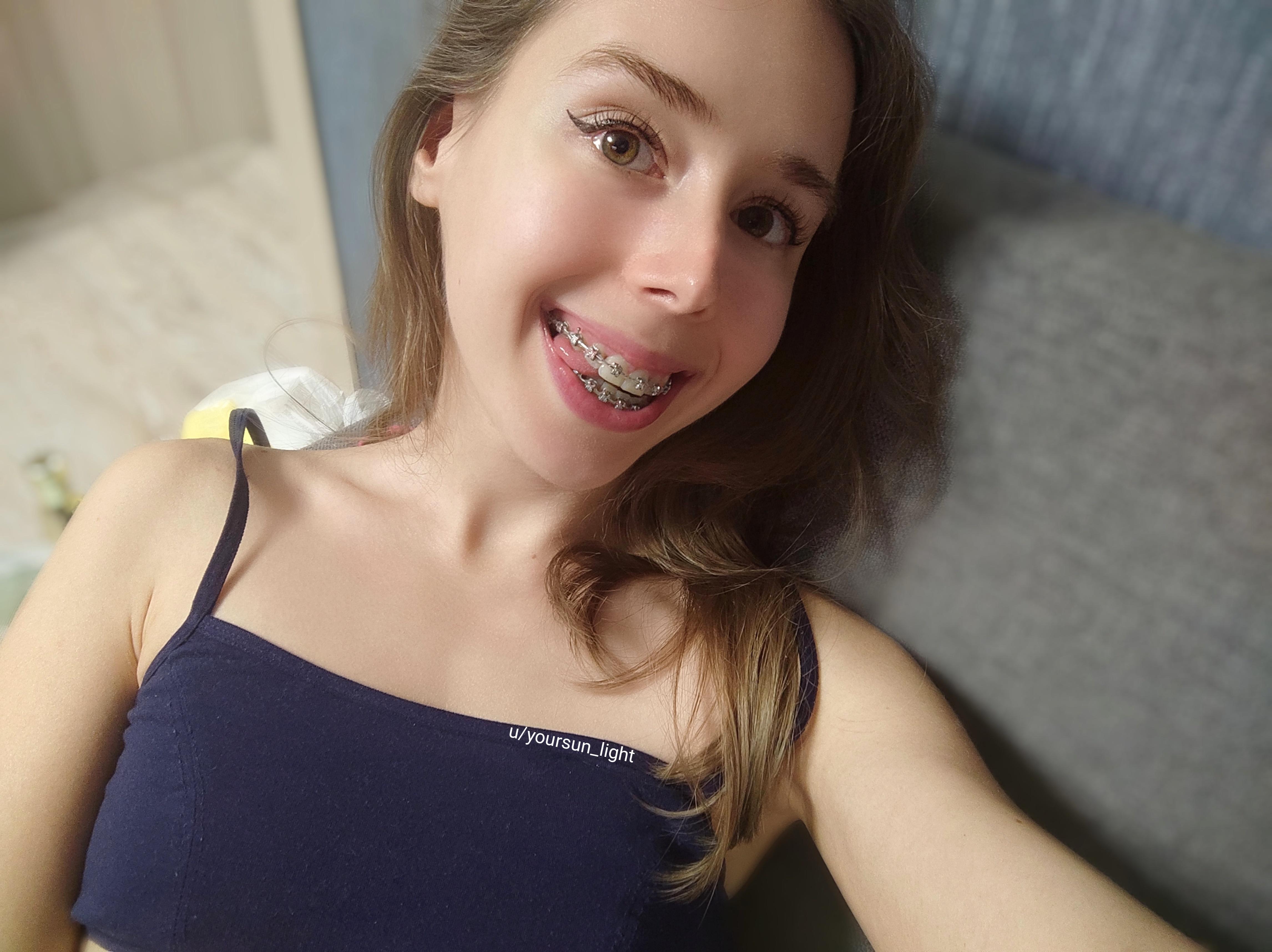 F21 Anyone like girls with braces? | Scrolller