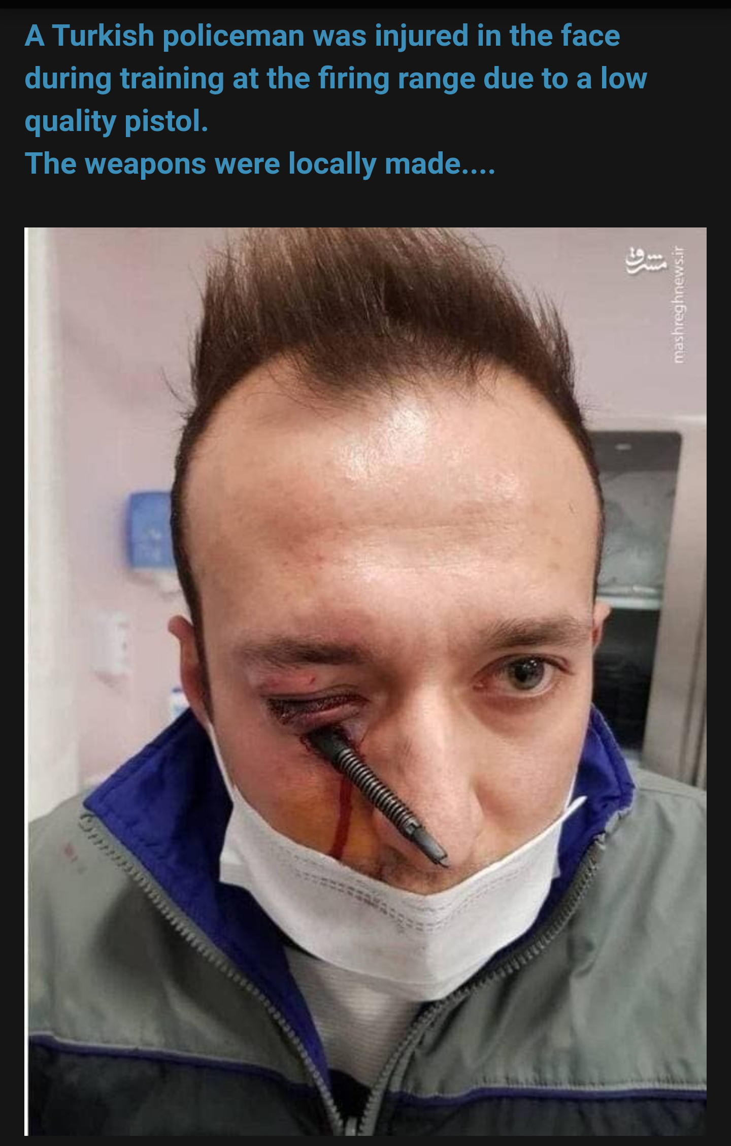 Facial injury | Scrolller