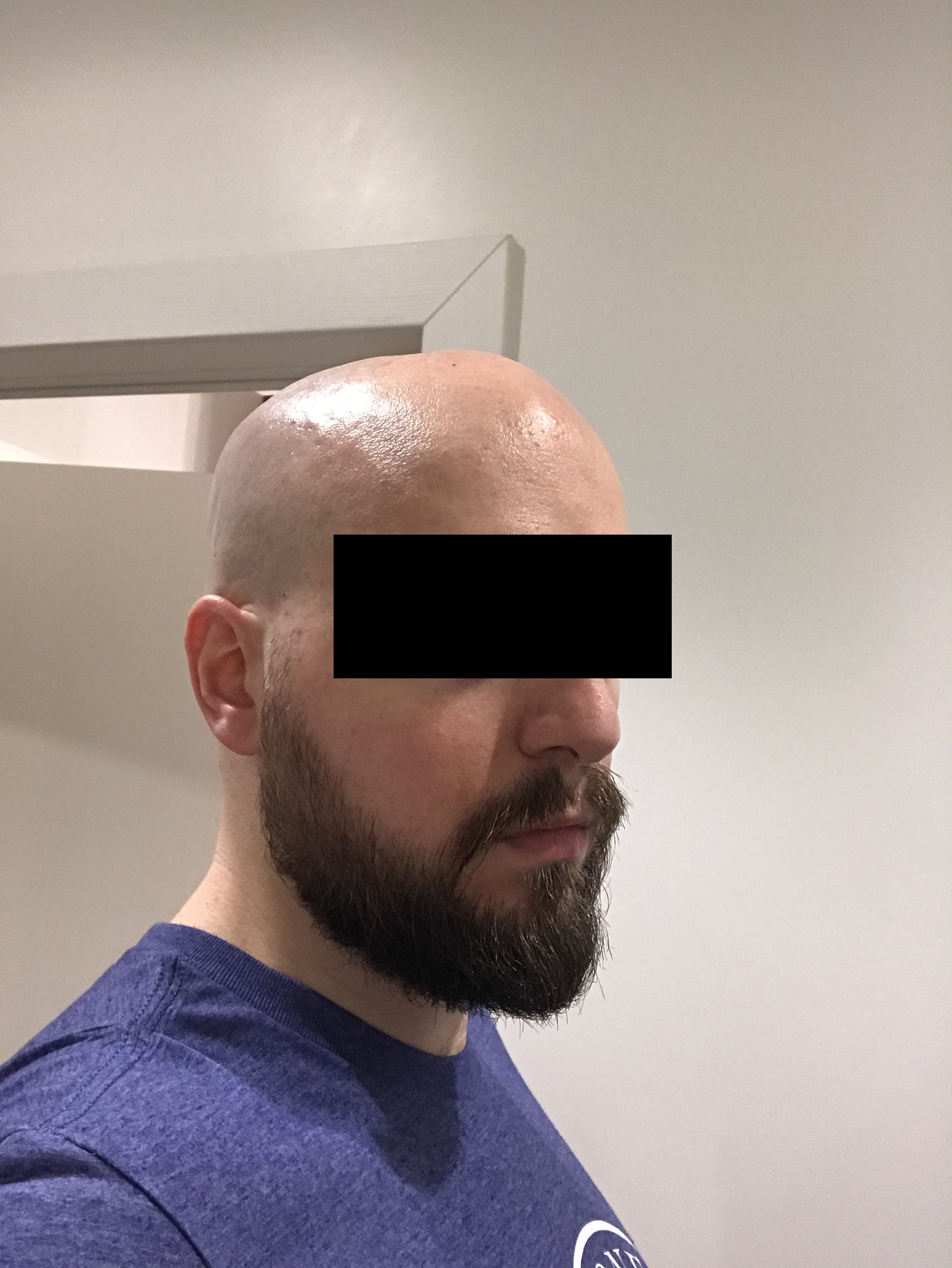 Feeling really good about my beard lately. | Scrolller