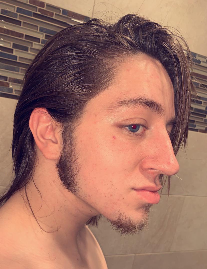 FEELING THE BURN? | Scrolller