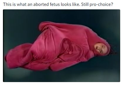 Fetus Deletus | Scrolller