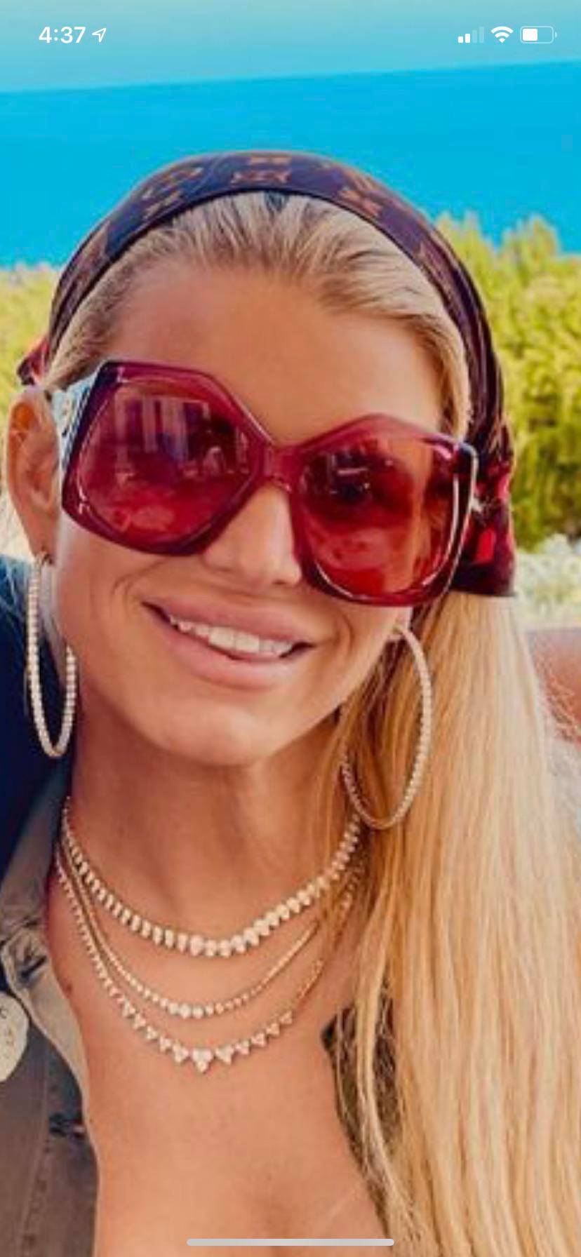 Filler gone wrong | Scrolller