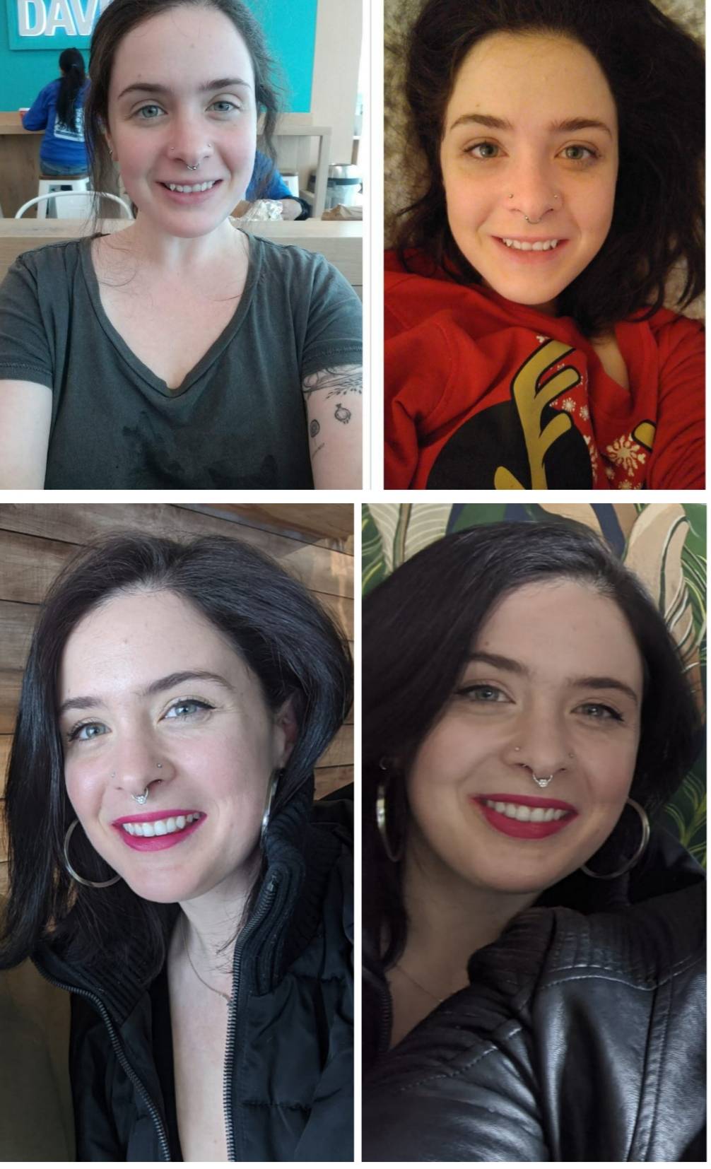 Final result! I can't believe how different I look...not just my teeth but the shape of my jaw ...