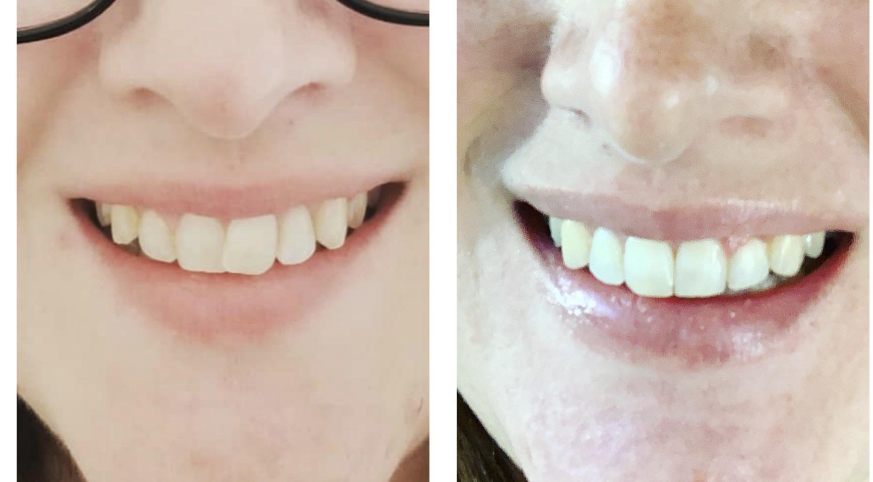 Finally Done Scrolller