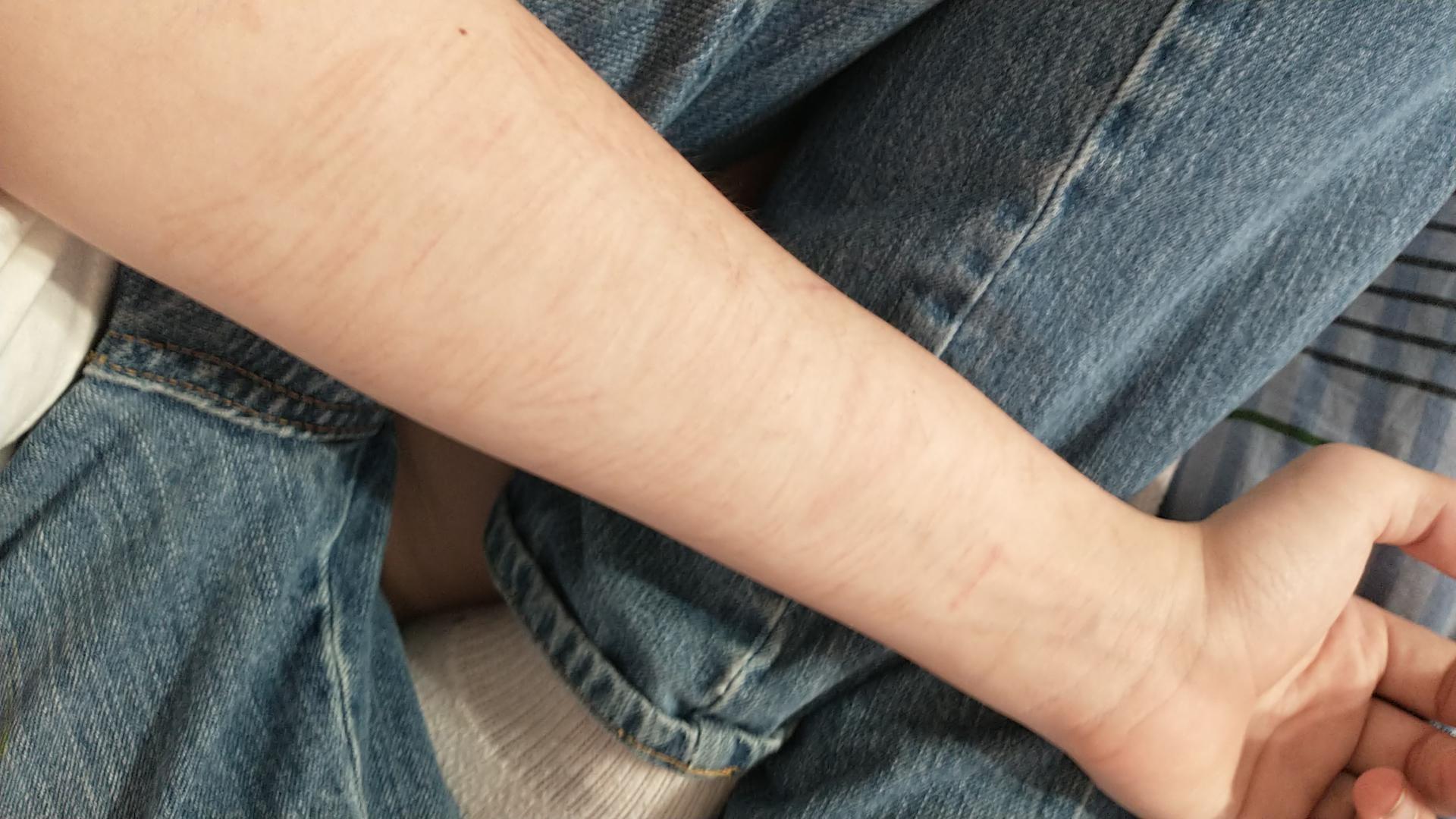 Finally fully healed | Scrolller