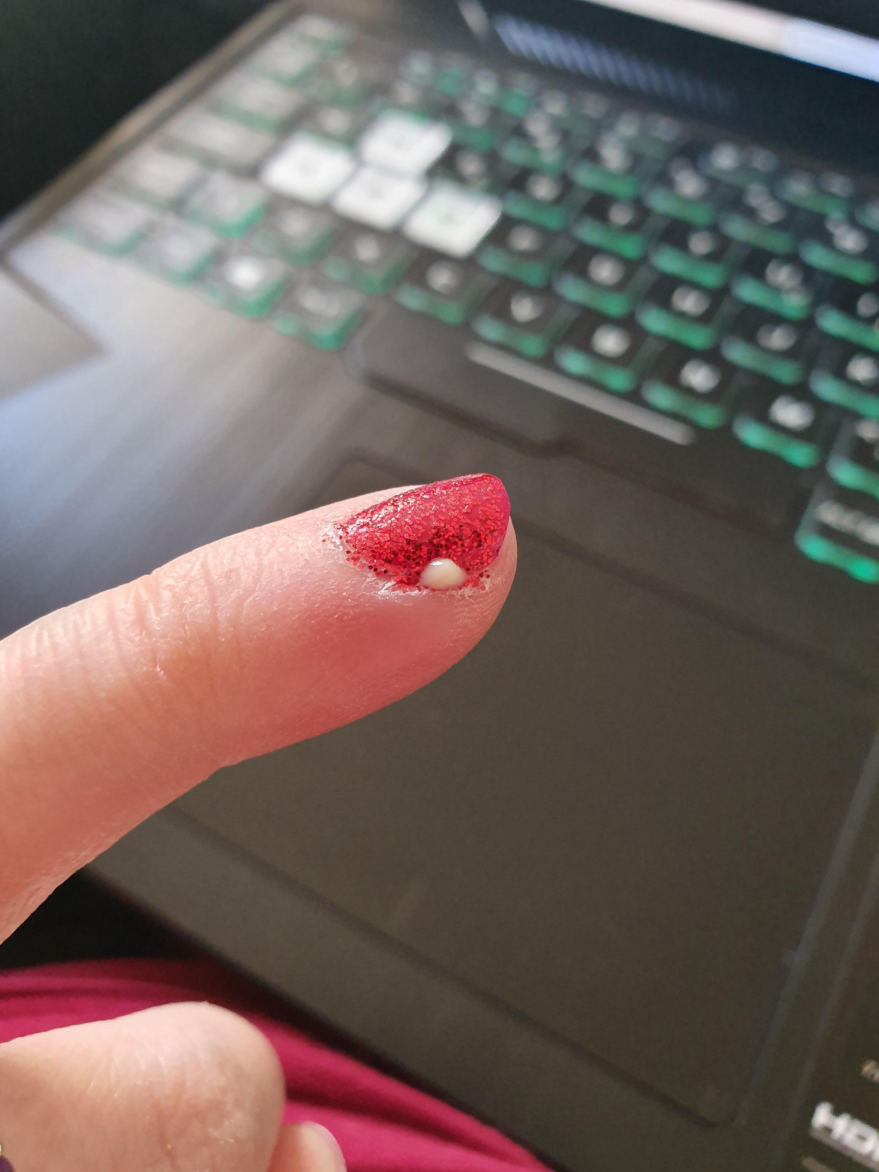 Finger was a bit tender, didnt expect this to squirt out or I would have filmed it! Tiny ...