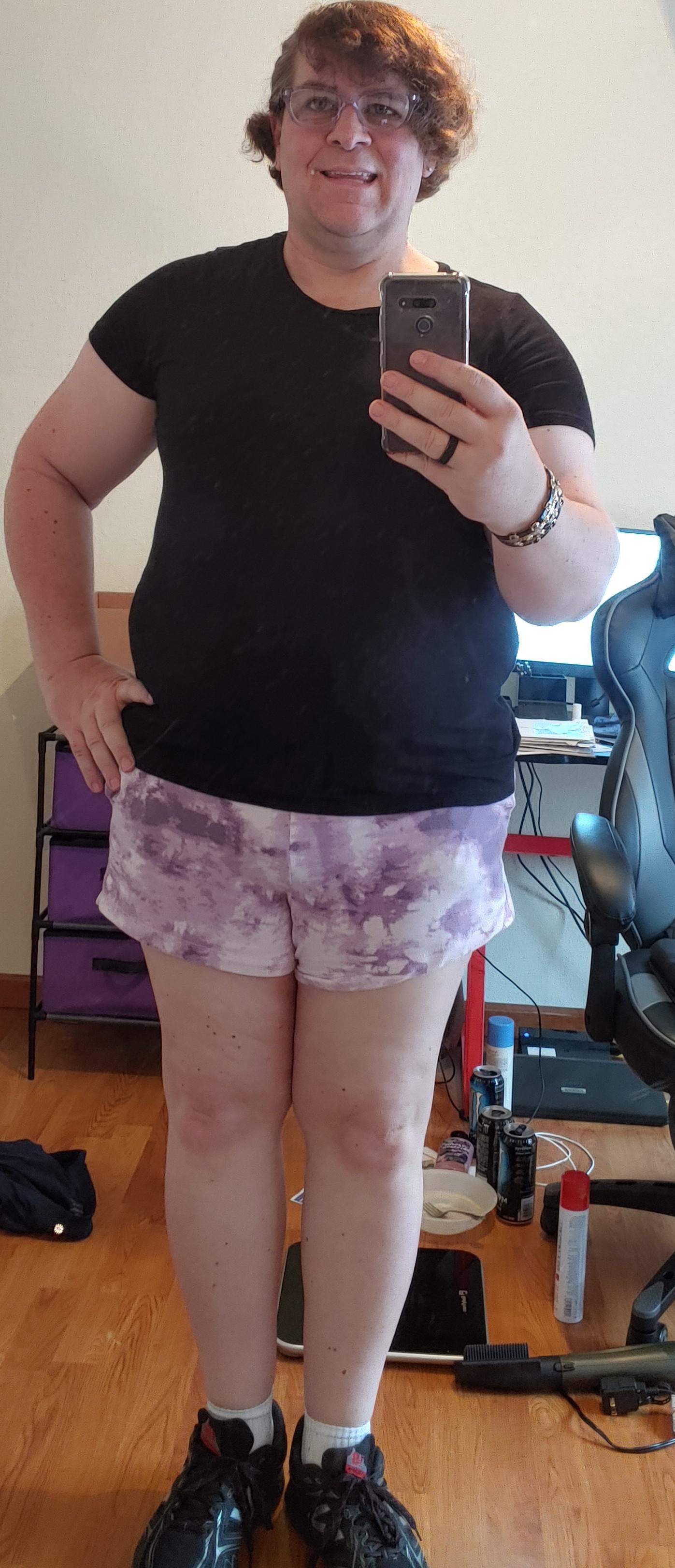 First time out in cute shorts! | Scrolller