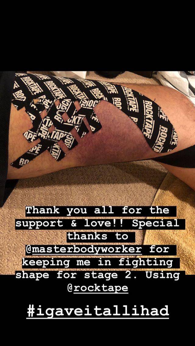 Flip’s leg | Scrolller