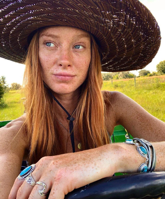 Freckled goddess | Scrolller