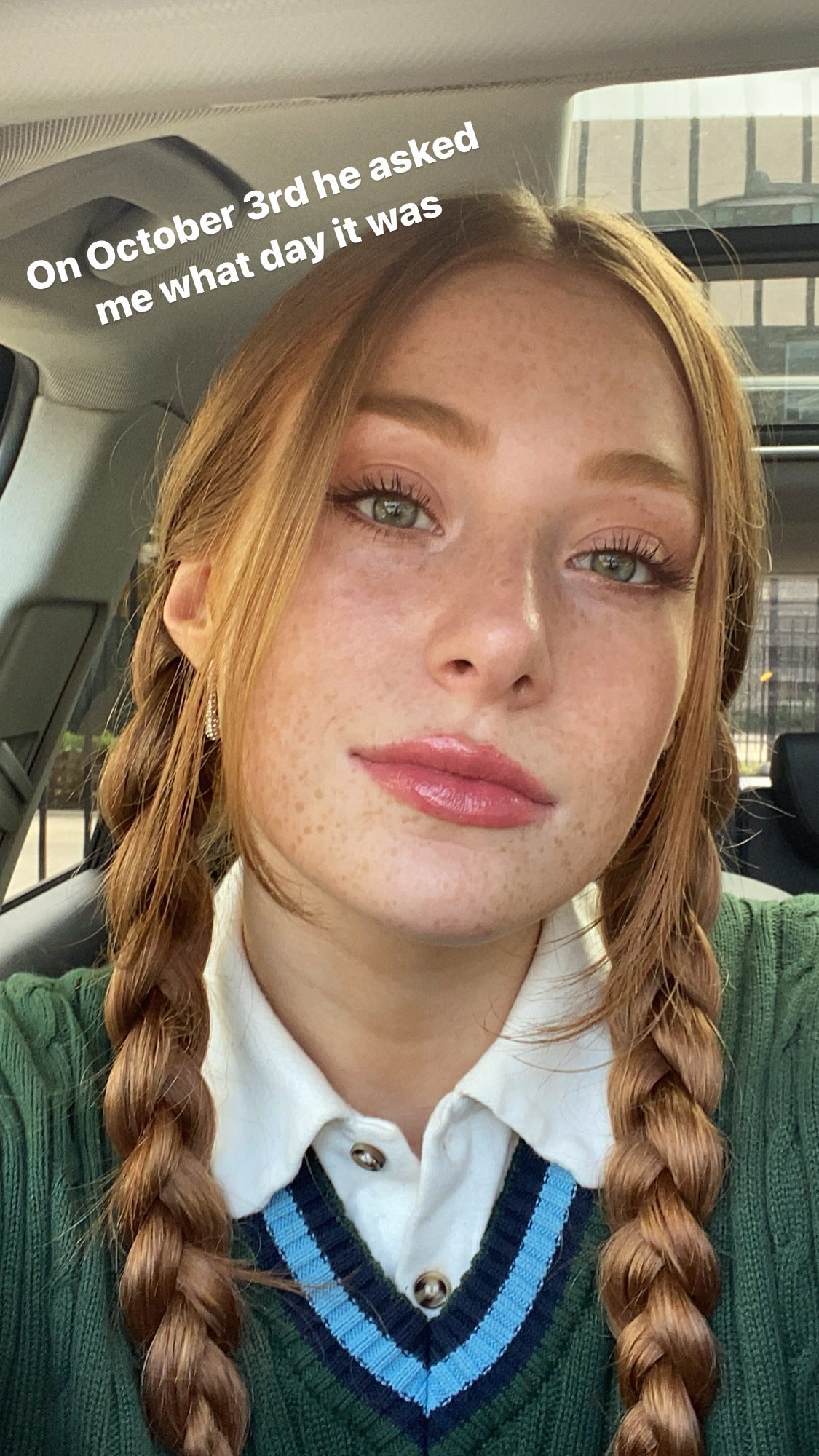 Freckles | Scrolller