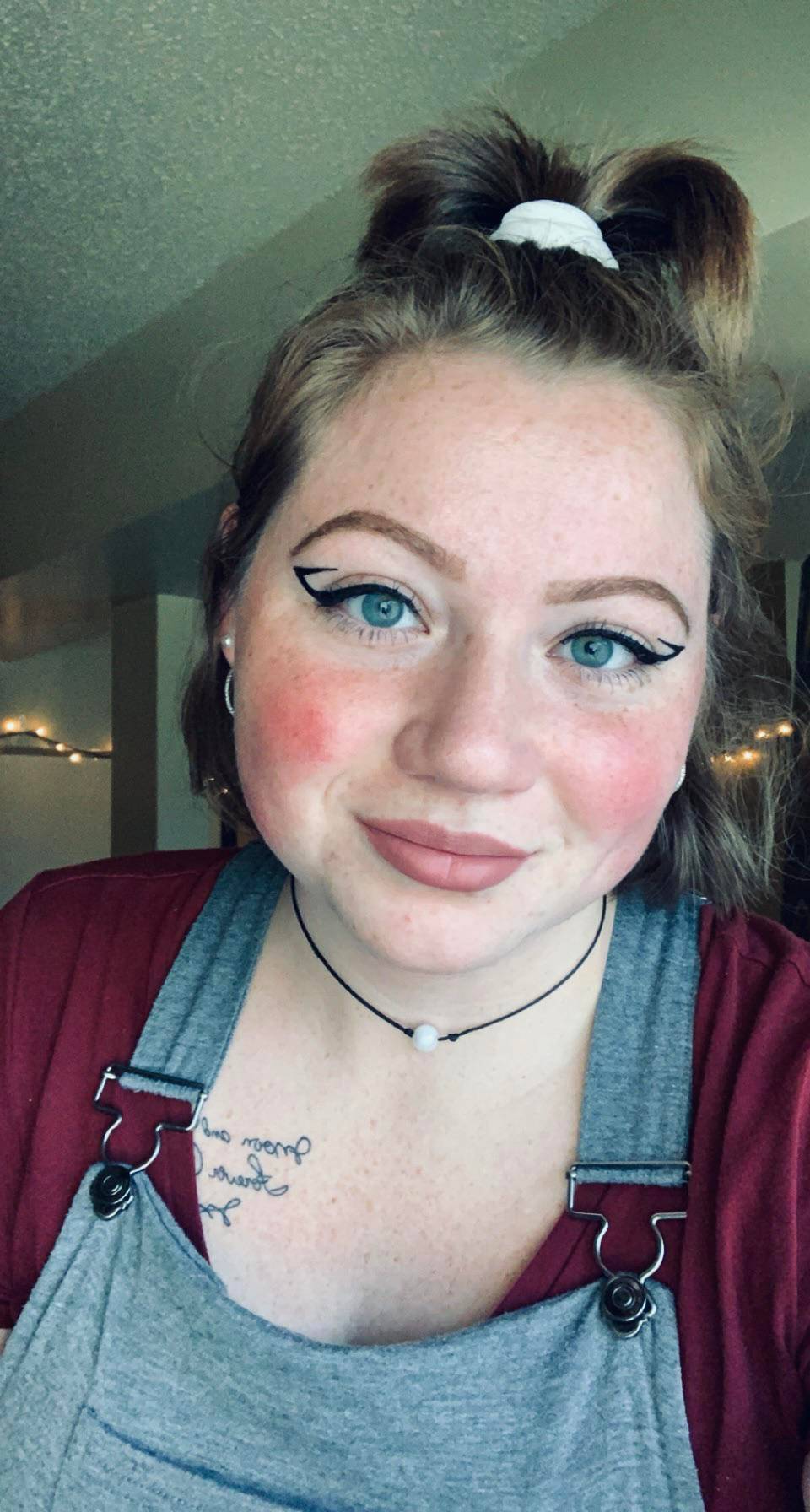Freckles and rosacea on full display | Scrolller