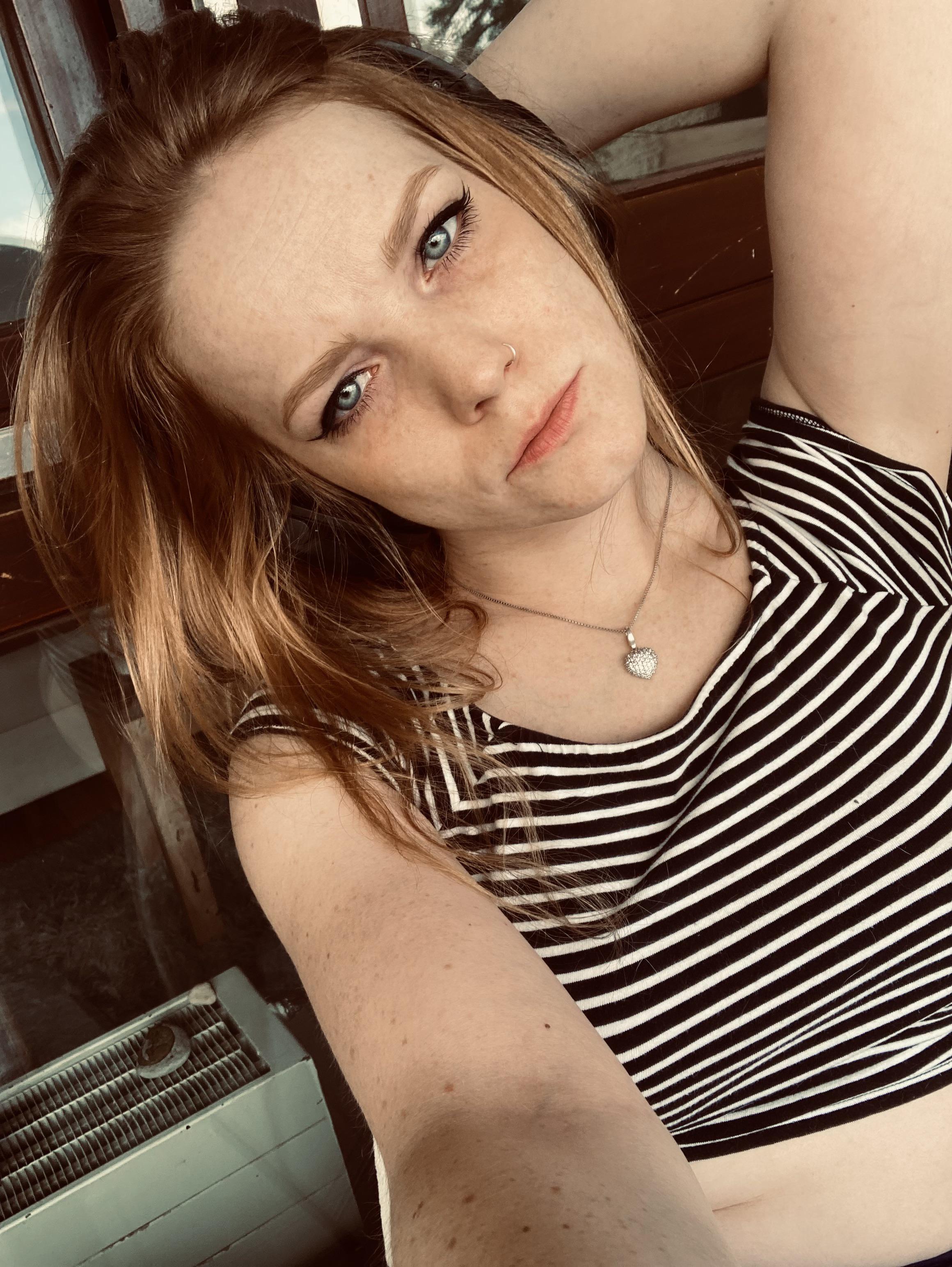 Freckles everywhere… | Scrolller