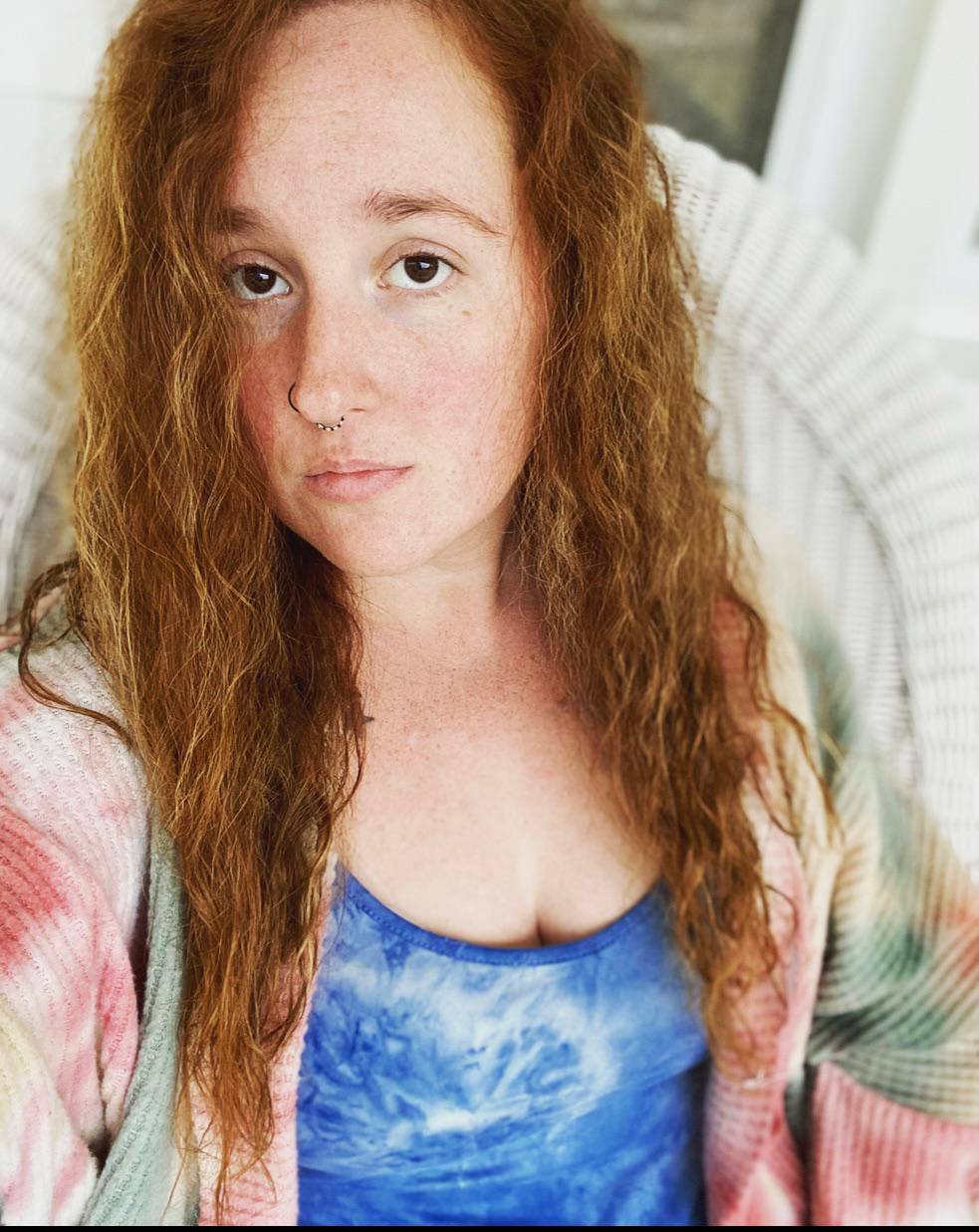 Freckles freckles everywhere | Scrolller