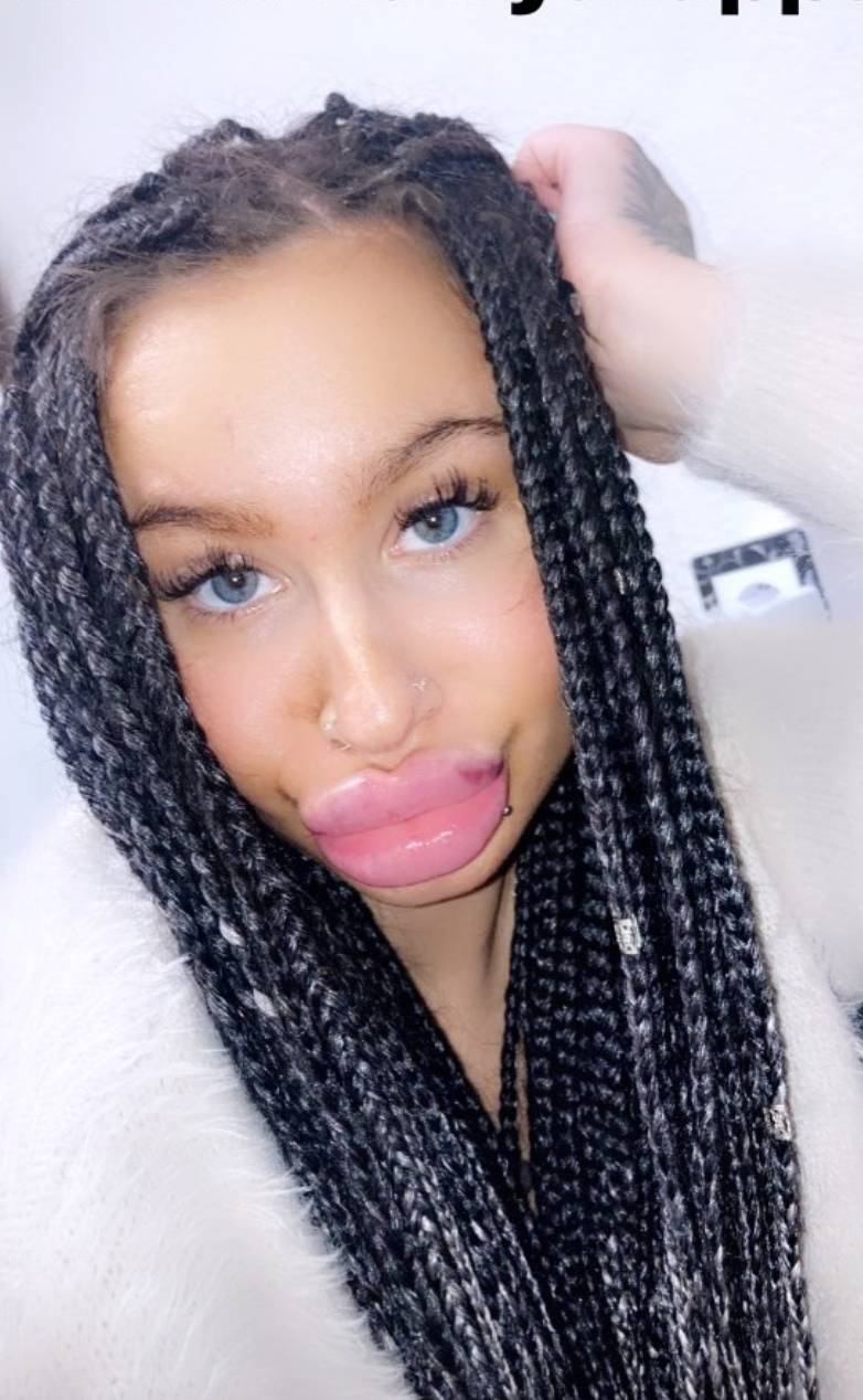 Freshly injected | Scrolller