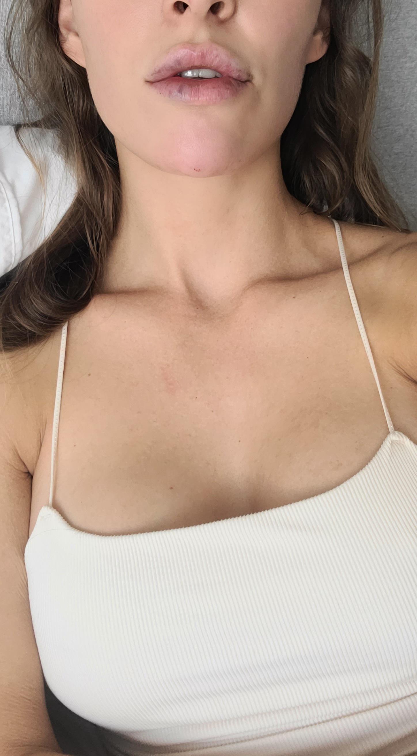 freshly poked | Scrolller