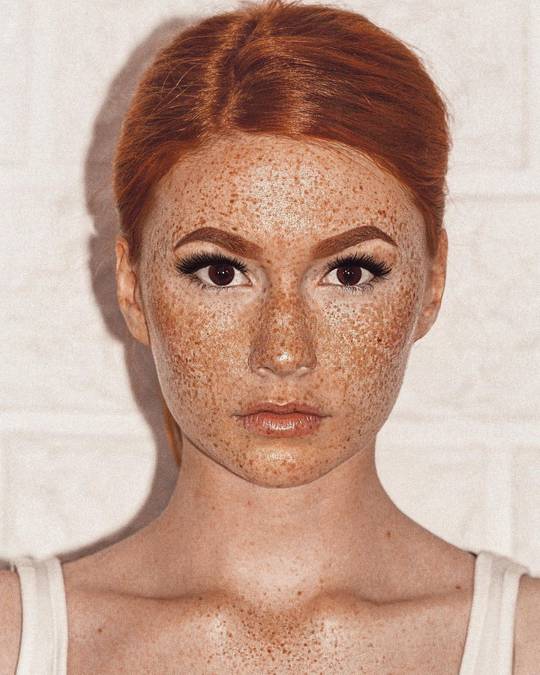 Ginger freckles 💘 | Scrolller