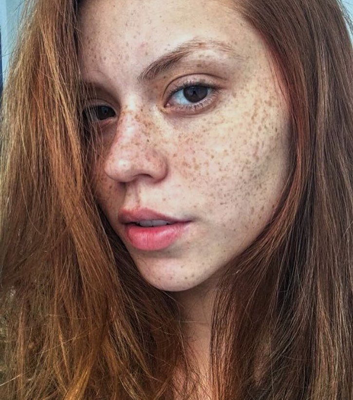 Ginger freckles ♥️ | Scrolller