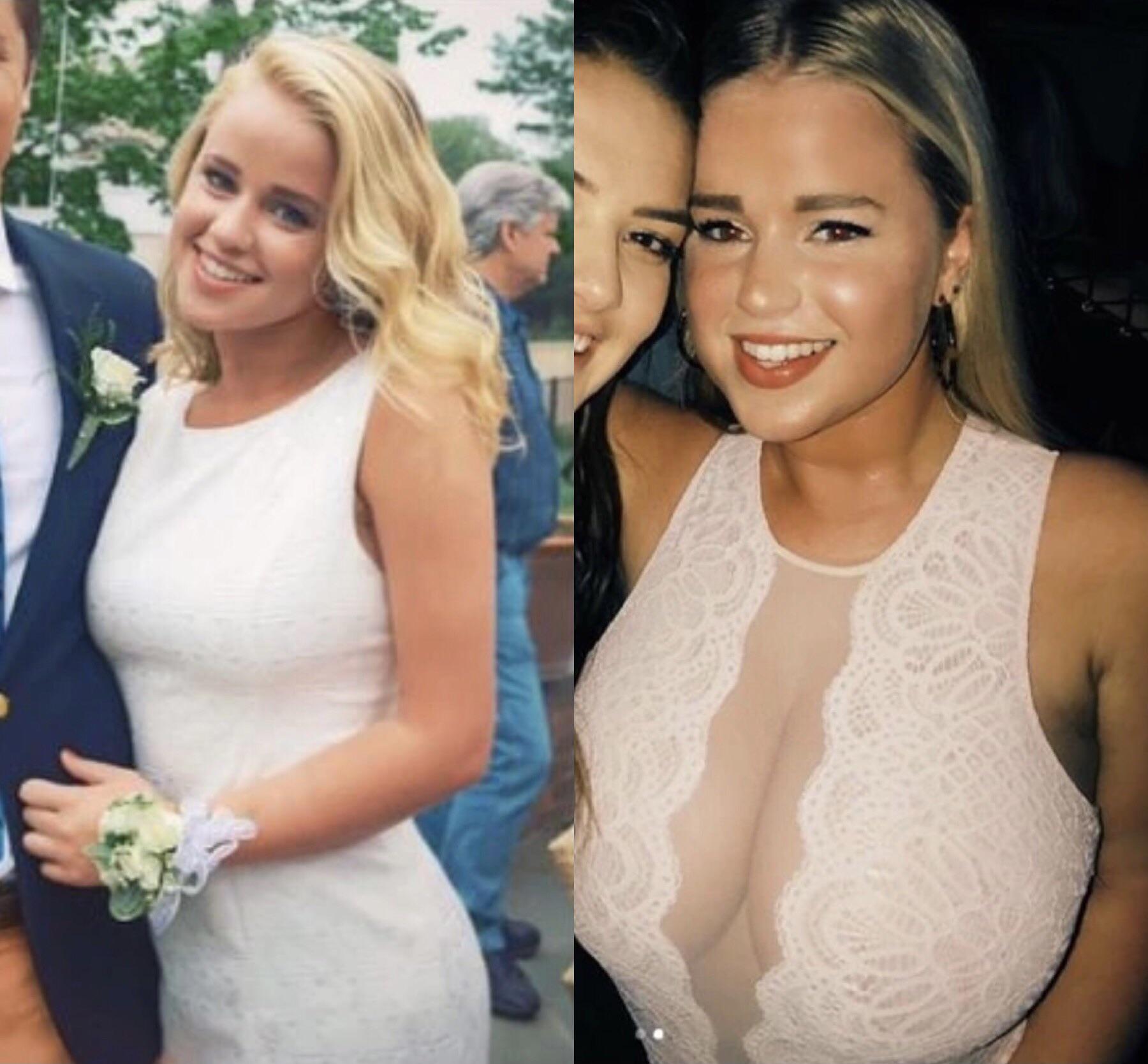 Girl went from small to gigantic | Scrolller