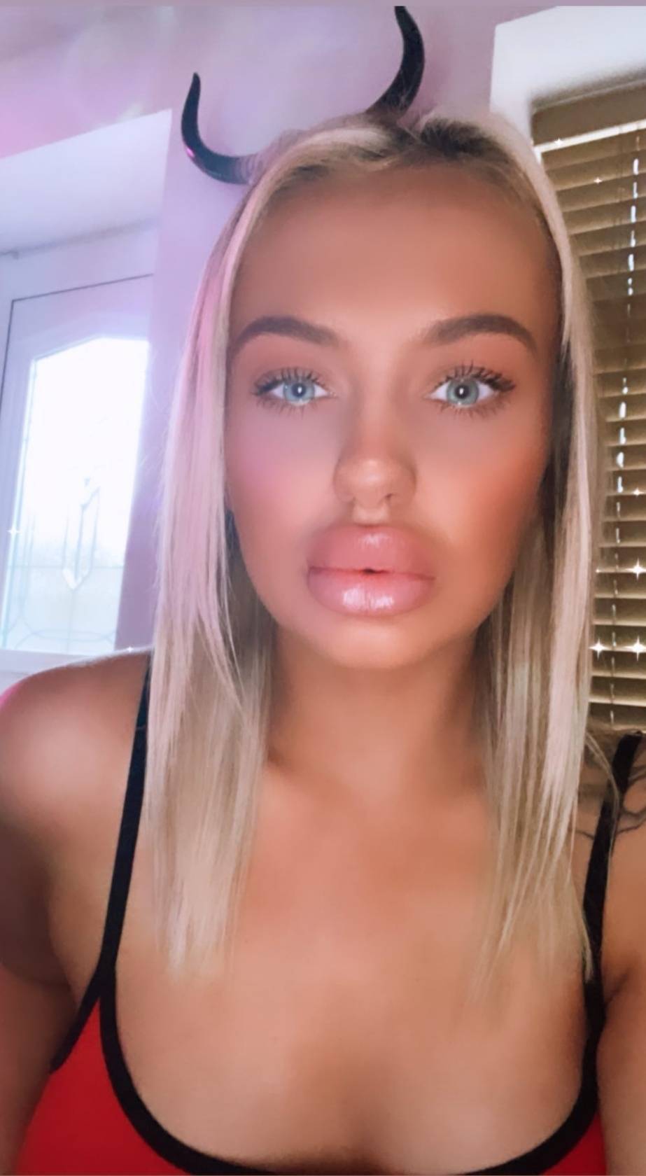 Glossy Big Lips | Scrolller