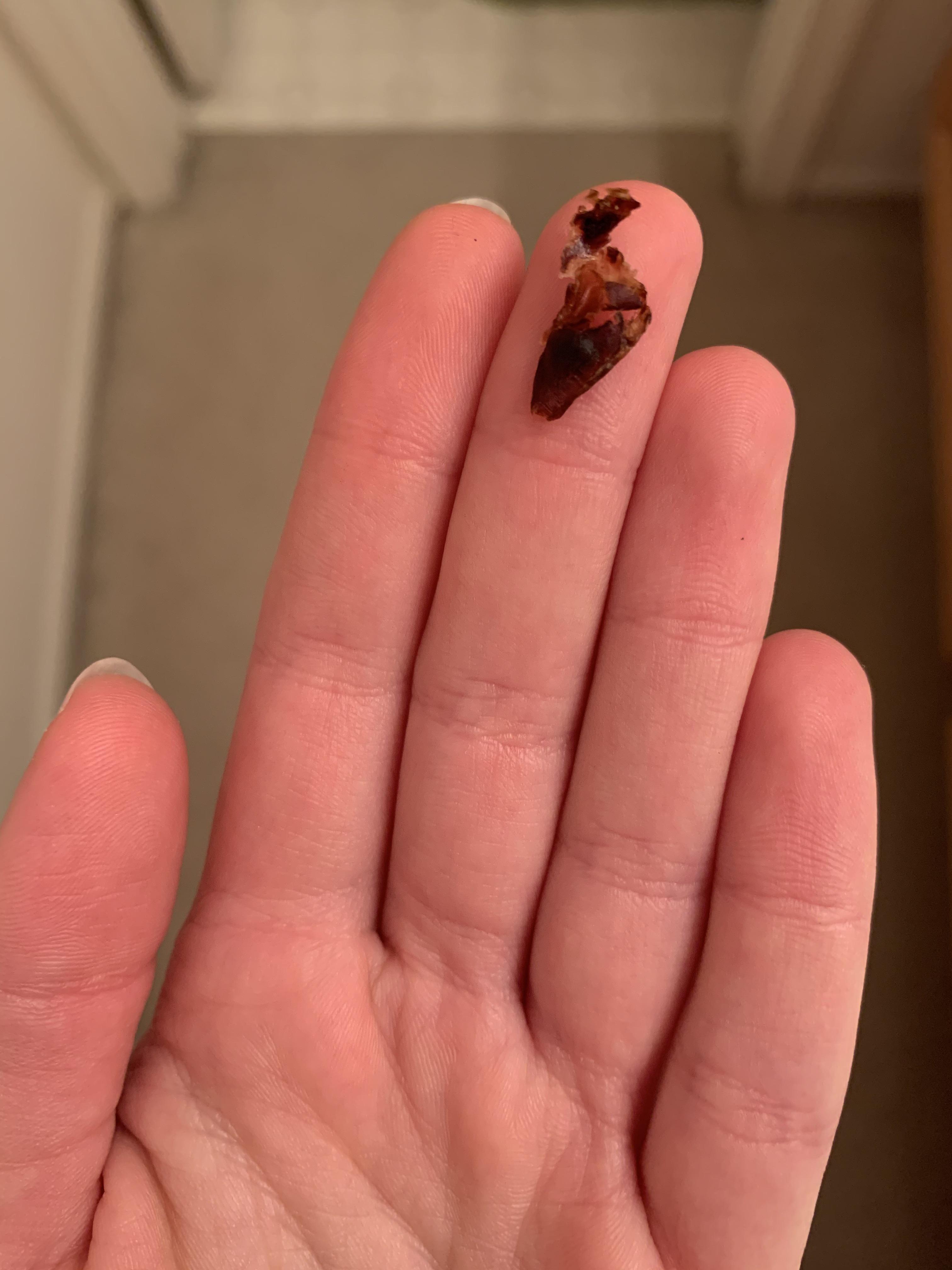 Had an ear infection 4 months ago; this came out of my ear today. (Hand for scale) | Scrolller