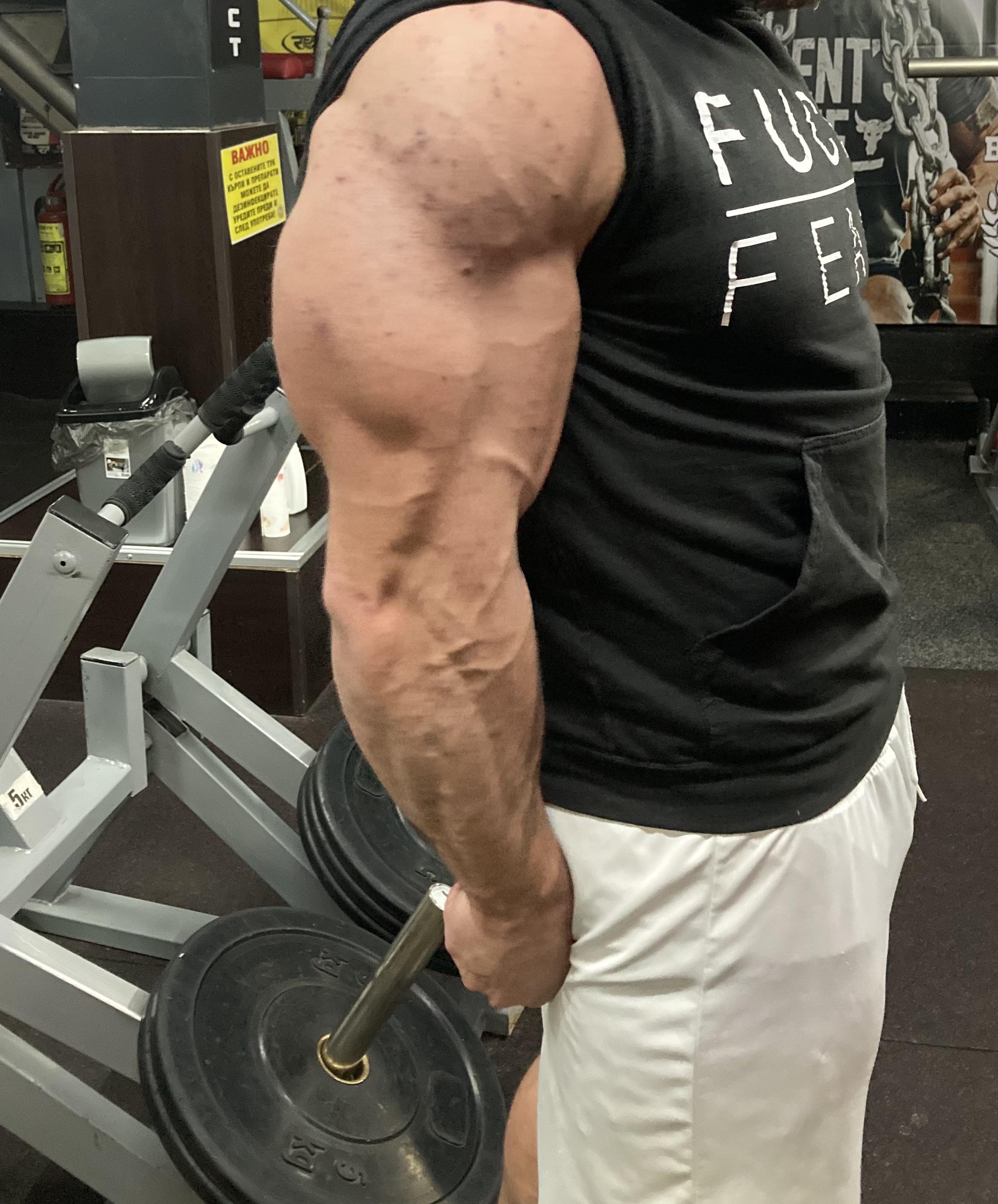 Hello again from mine forearm 🥵 | Scrolller