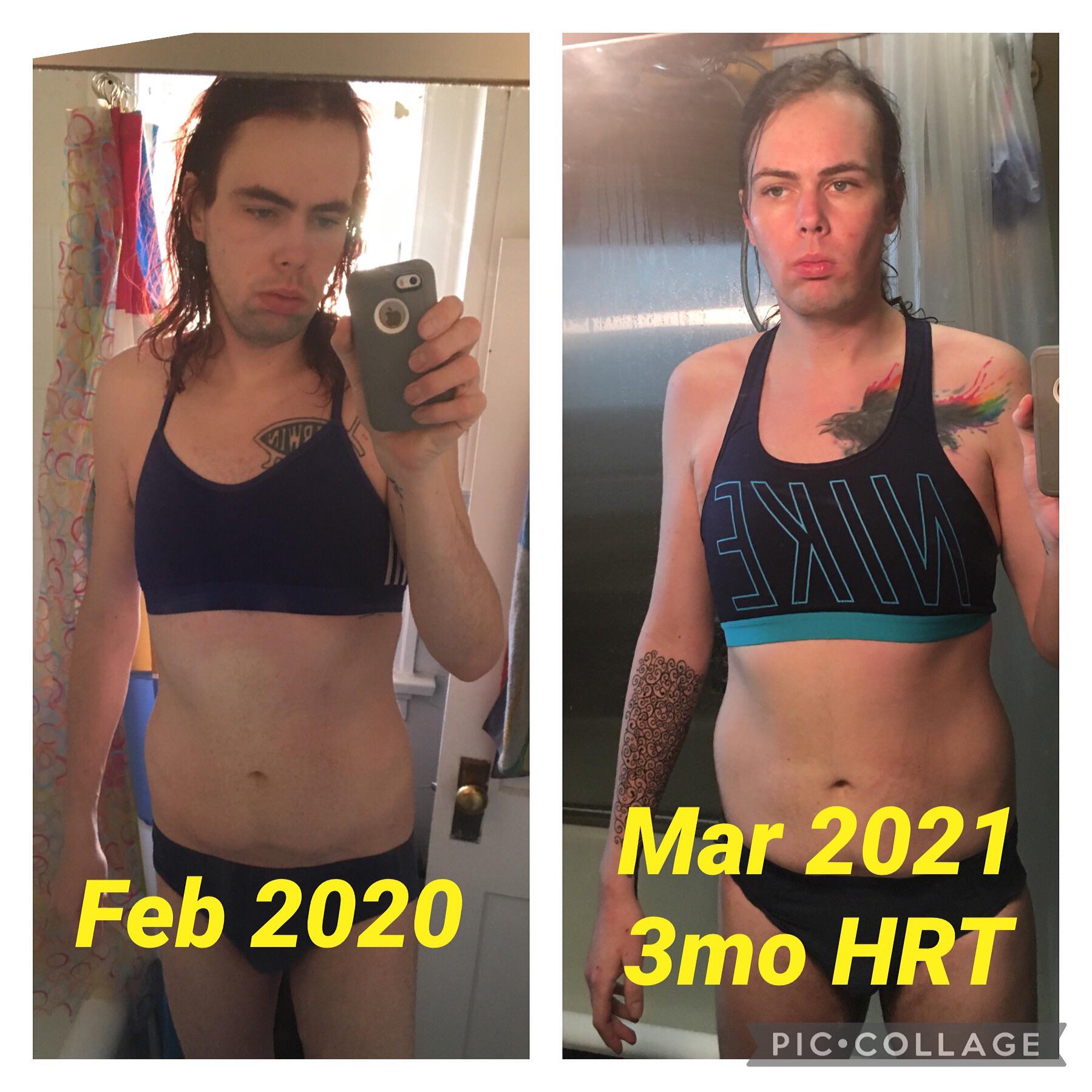 Hit 3 months HRT last week, and have been loving every step of the process. Feb 2020 vs this ...