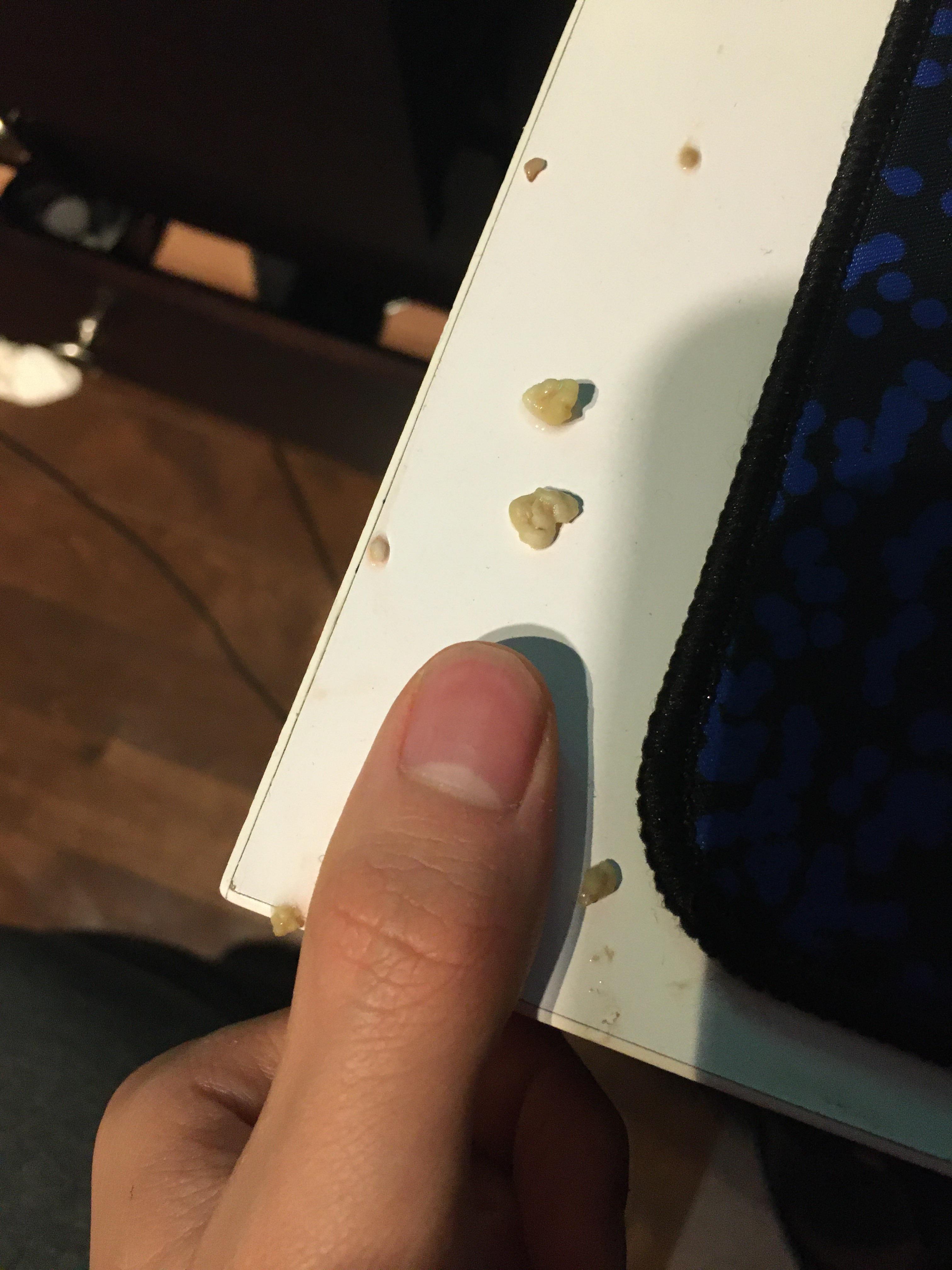 Holy shit these were big (my thumb for comparison) | Scrolller