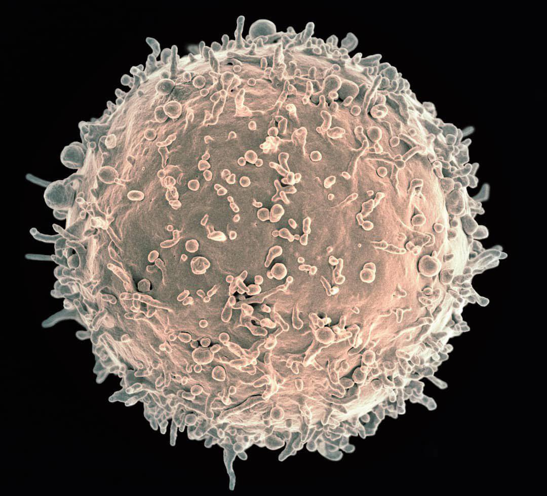 Human β cell, SEM | Scrolller