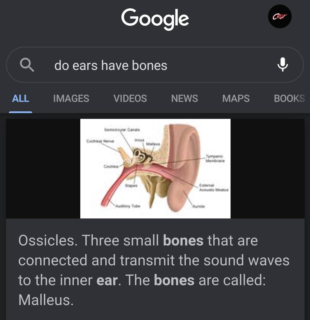 I got my ear chopped off once but all the ear bones are inside your head 💪💪💪🦴🦴🦴 | Scrolller