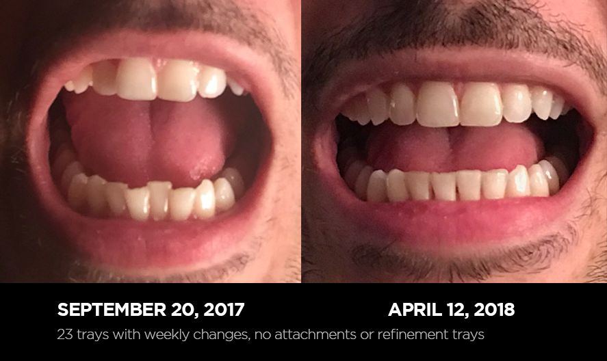 I'm done!! 23 trays with weekly changes | Scrolller