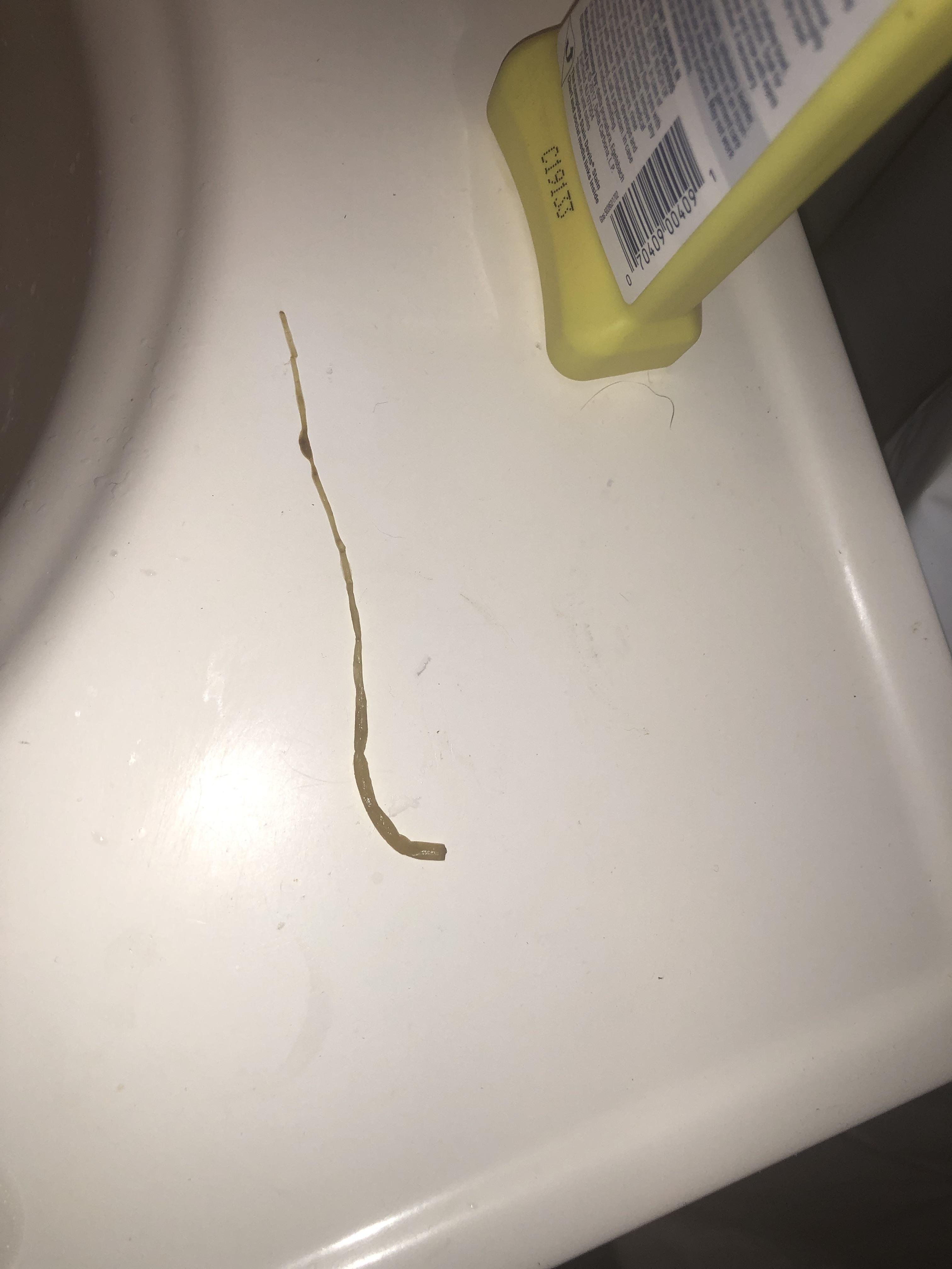 Is this a worm 😩 | Scrolller