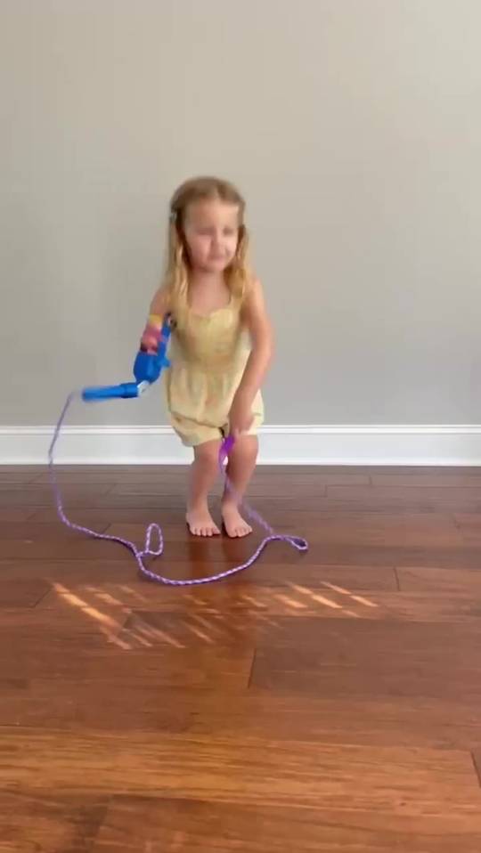Jump rope prosthetic | Scrolller