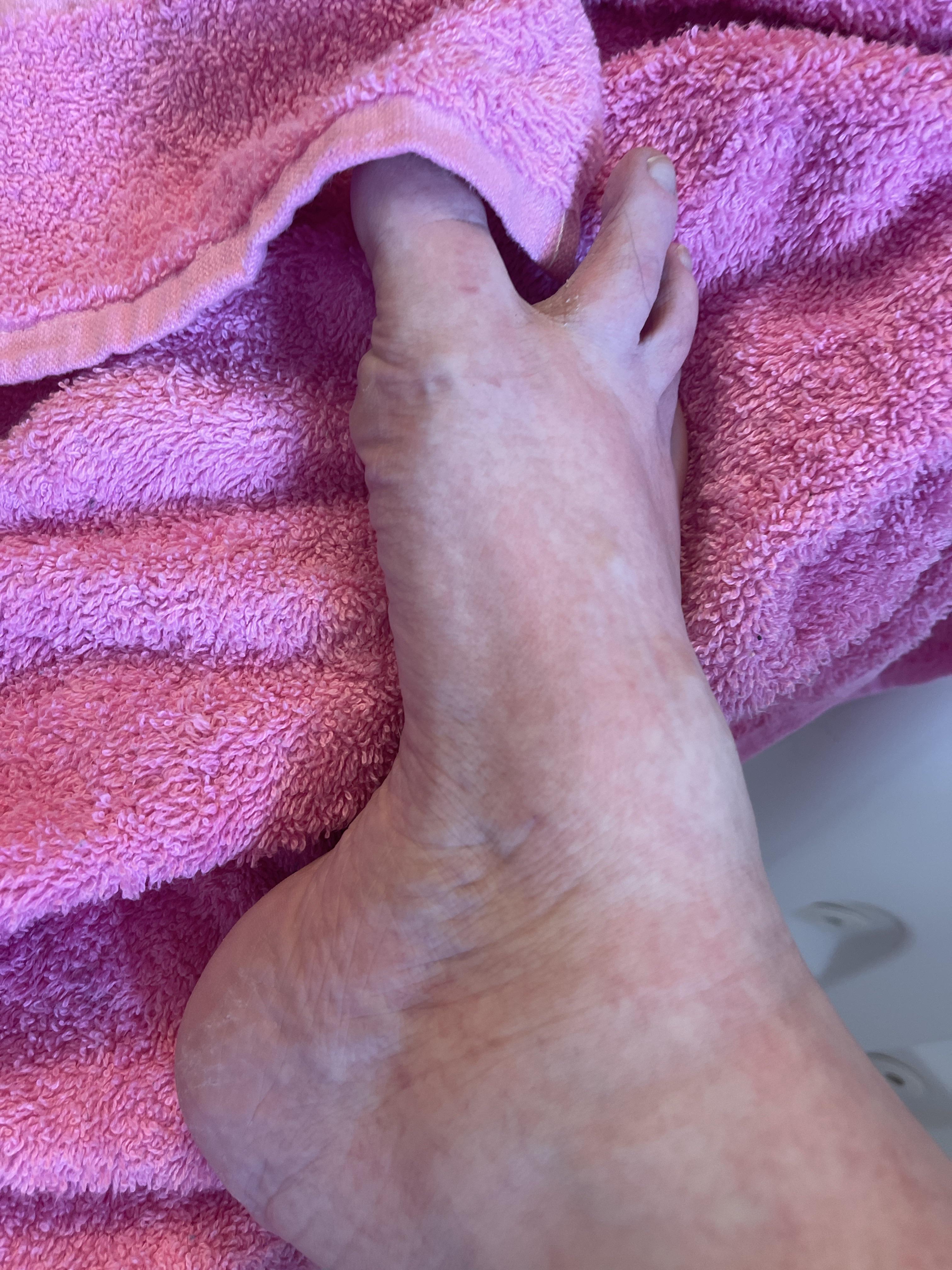 Just drying off. | Scrolller