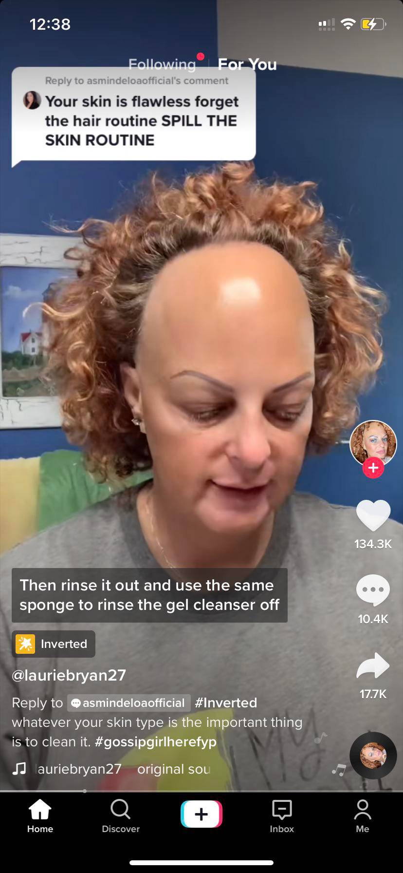 Just look at the head | Scrolller