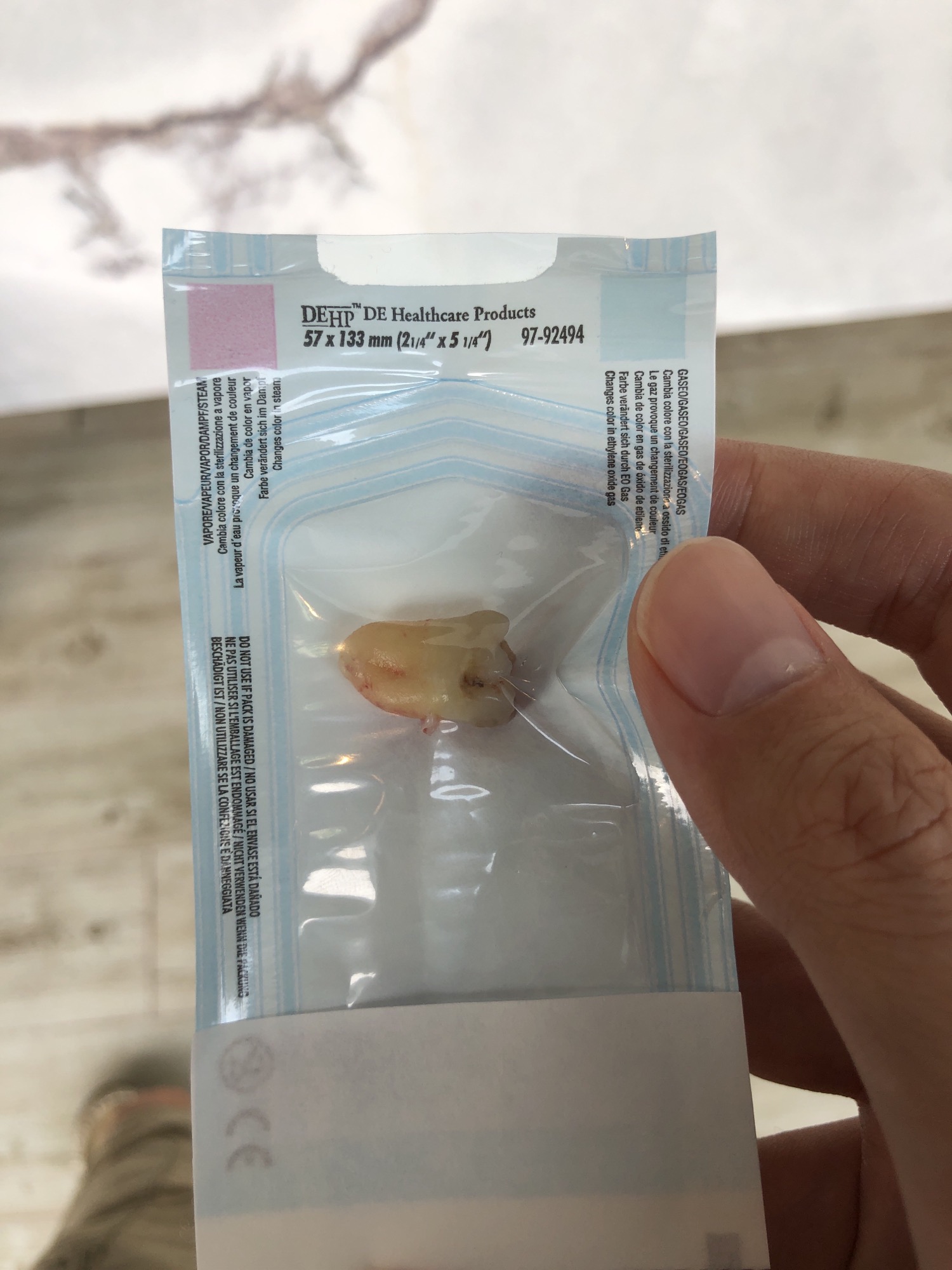 just pulled out my wisdom teeth | Scrolller