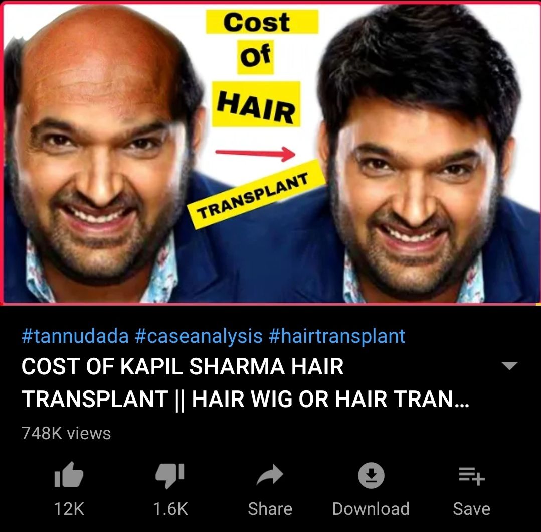 Kapil Sharma before and after becoming a NeoChode | Scrolller