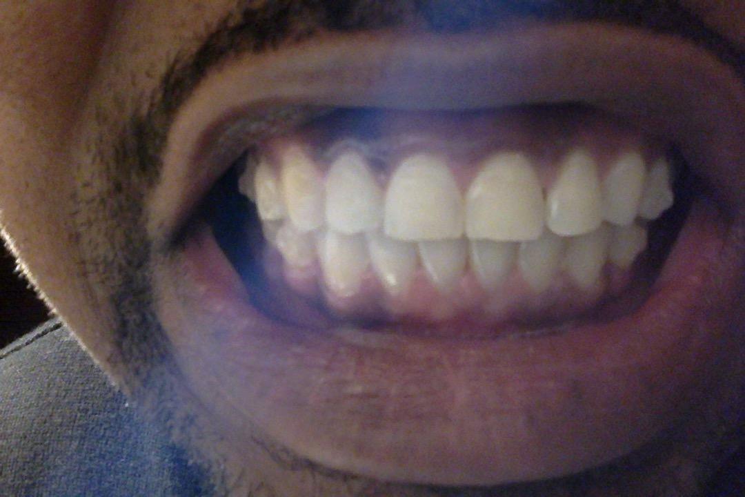 Last shot before refinements | Scrolller