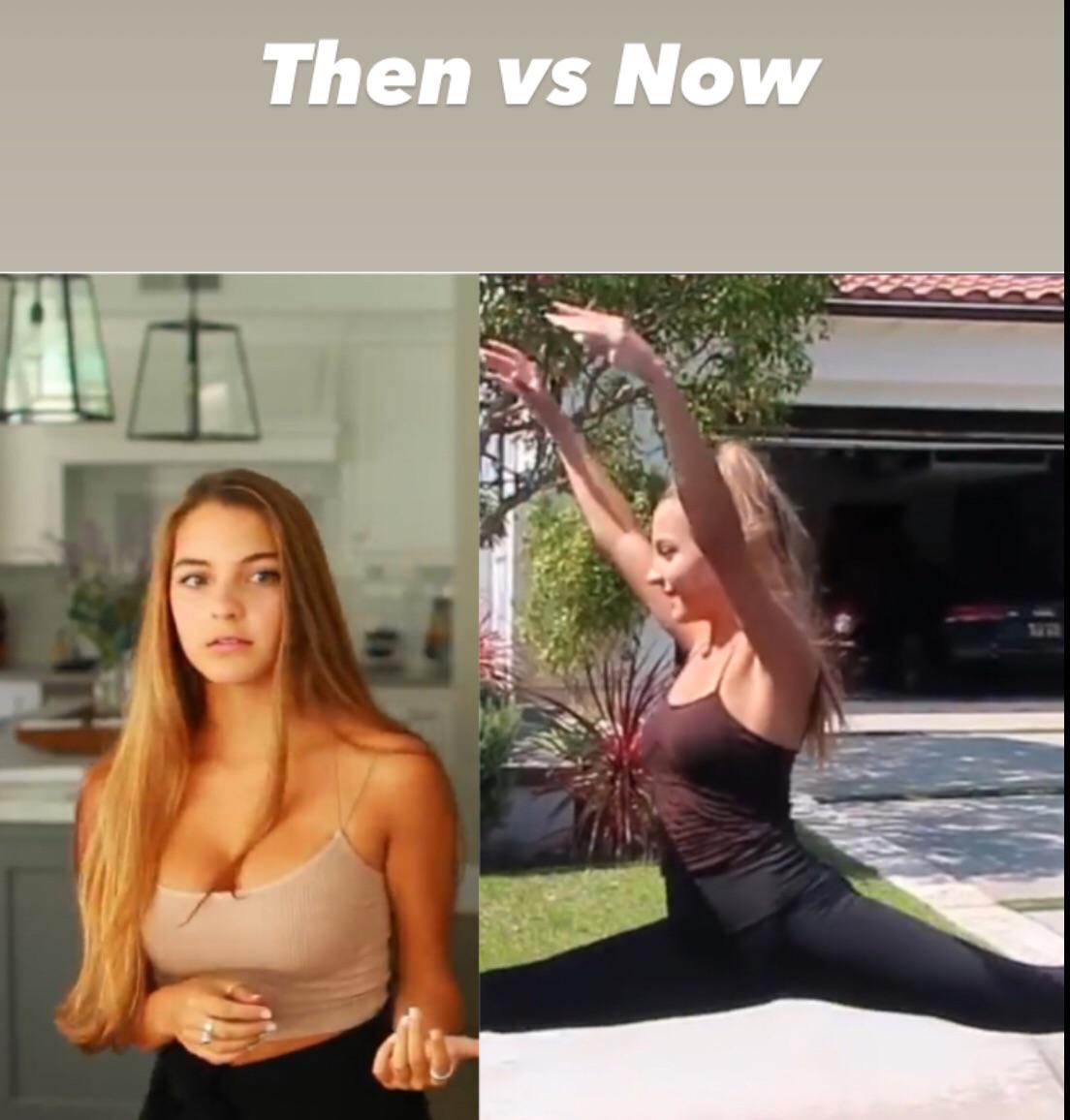 Lexi tits then vs now 🍒 | Scrolller