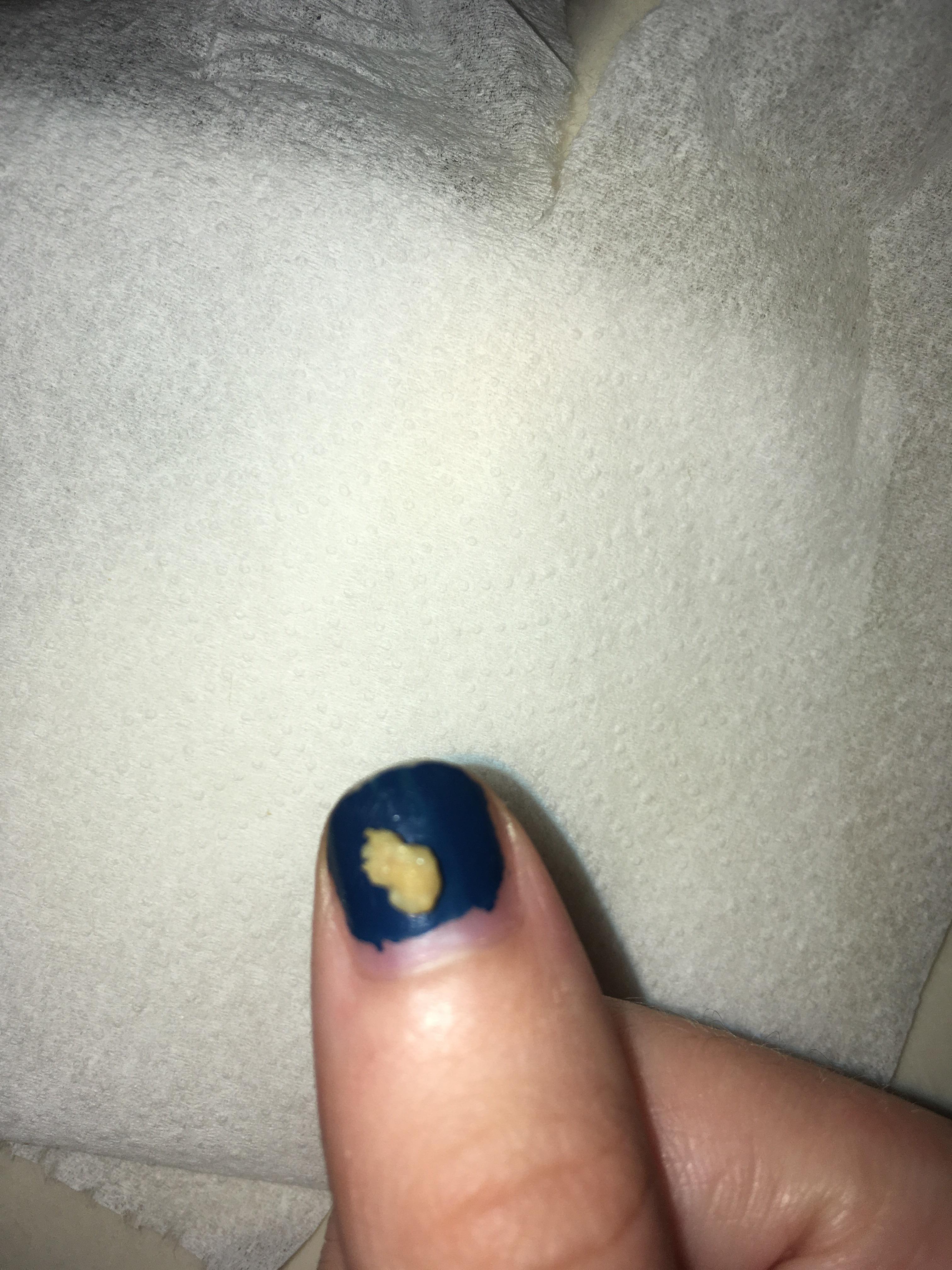 long time lurker first time poster | Scrolller