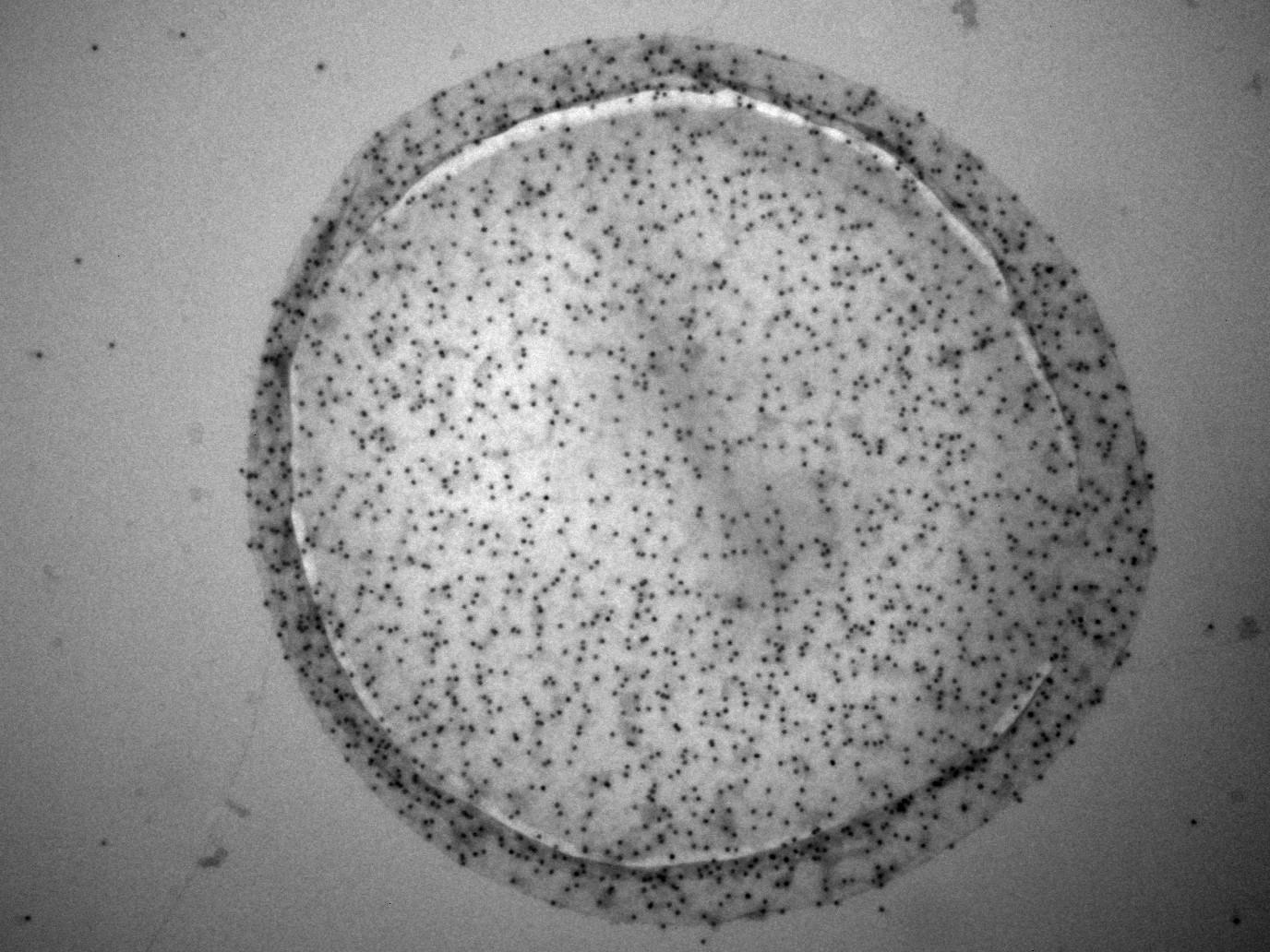 Look at my first ever TEM image, it's goddamn gorgeous! | Scrolller