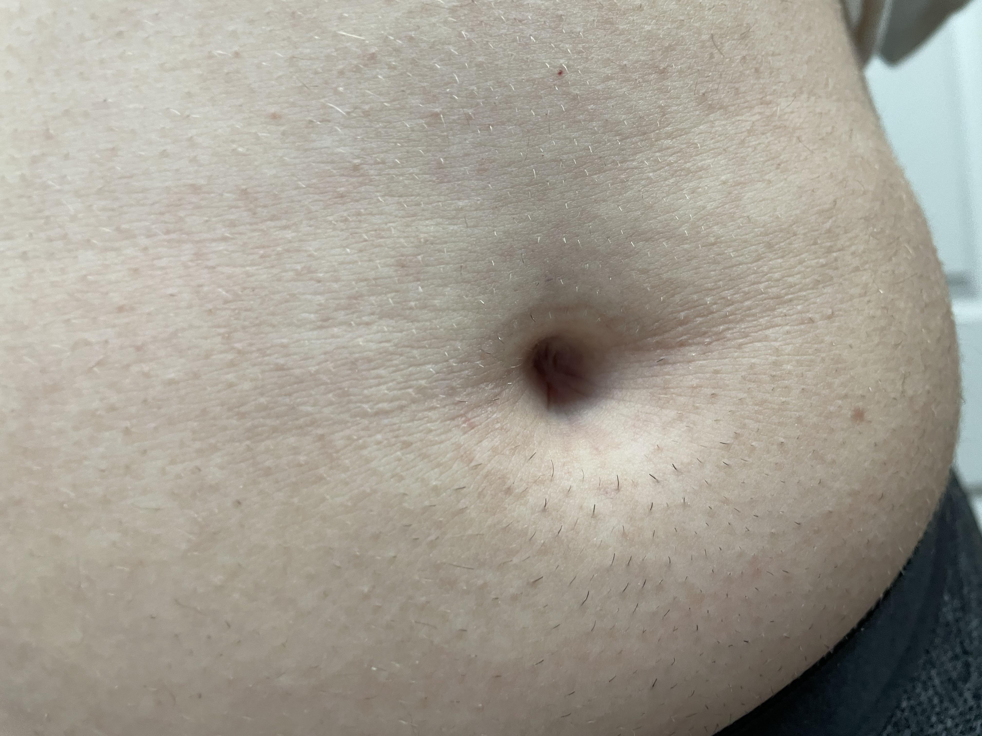 Look inside [M]y navel and see all the detail! | Scrolller