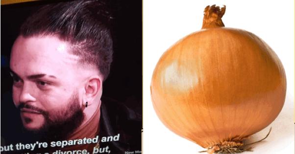 Looking like a damn onion. | Scrolller