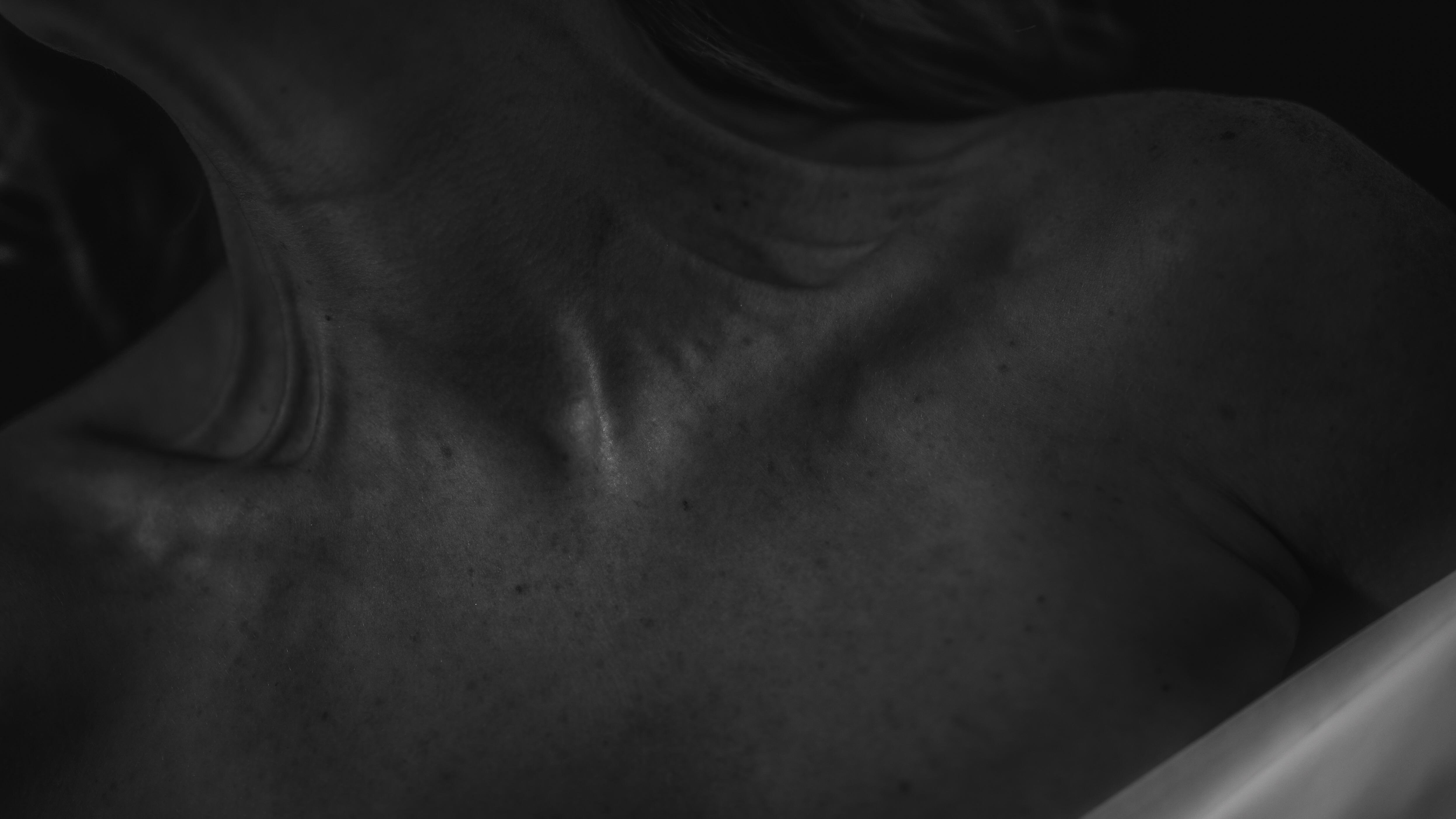 Love this very interesting photo of my strained neck/collarbone | Scrolller