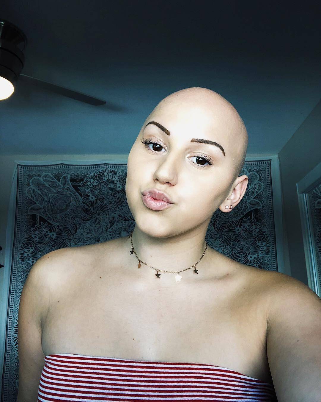 Lovely lips | Scrolller