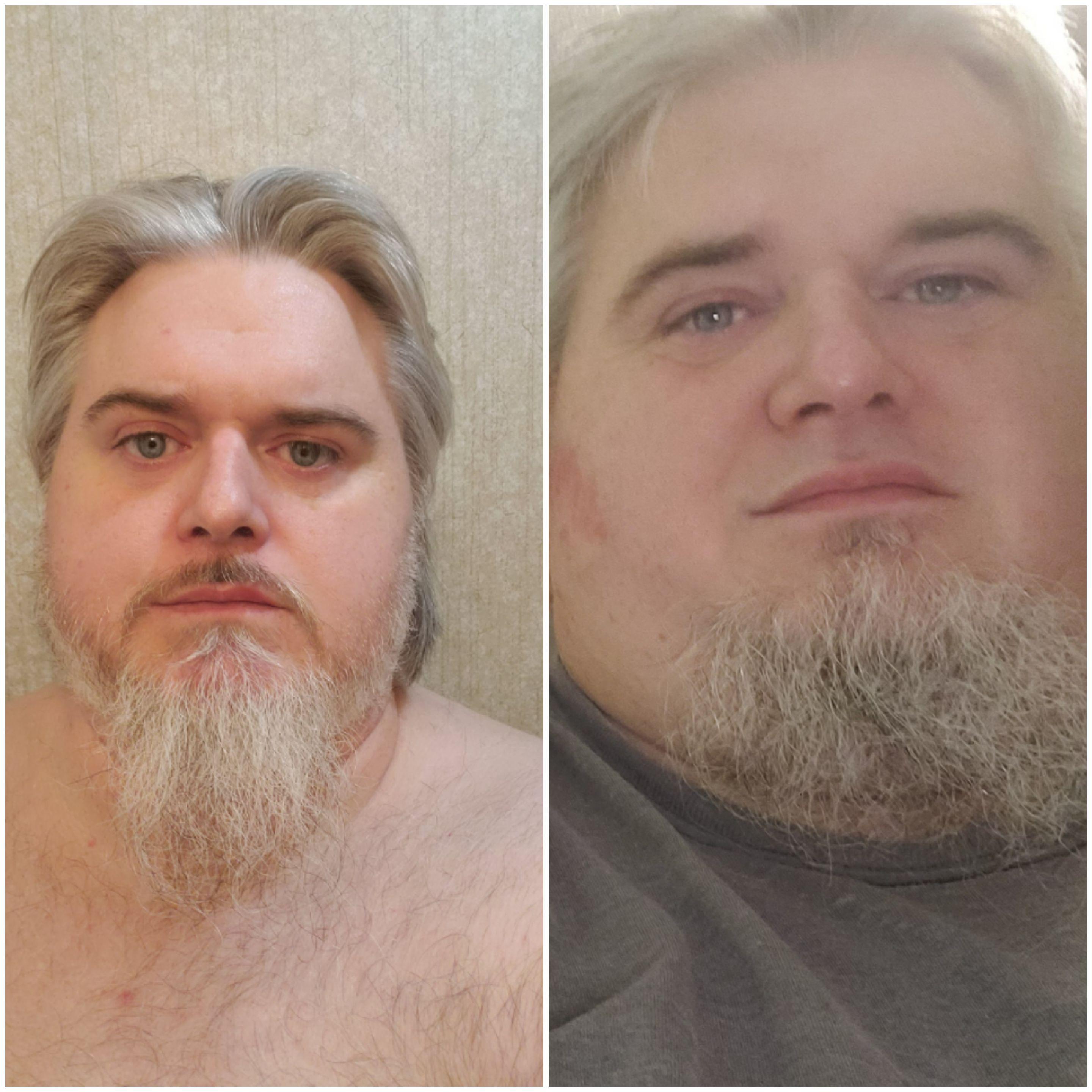 M/38/5'11[467>395=72lbs](3 months) | Scrolller