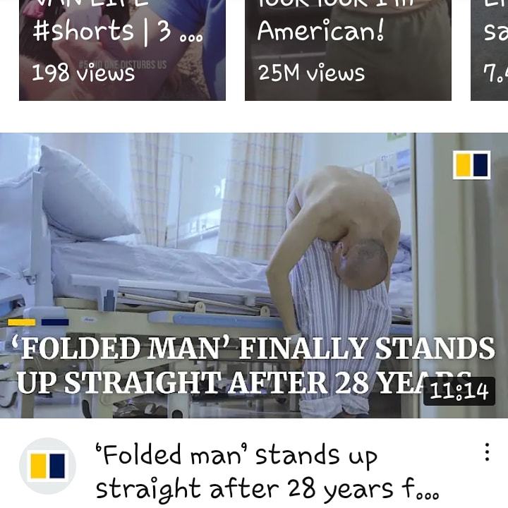 Man in China gets 4 surgeries to finally stand straight!! | Scrolller